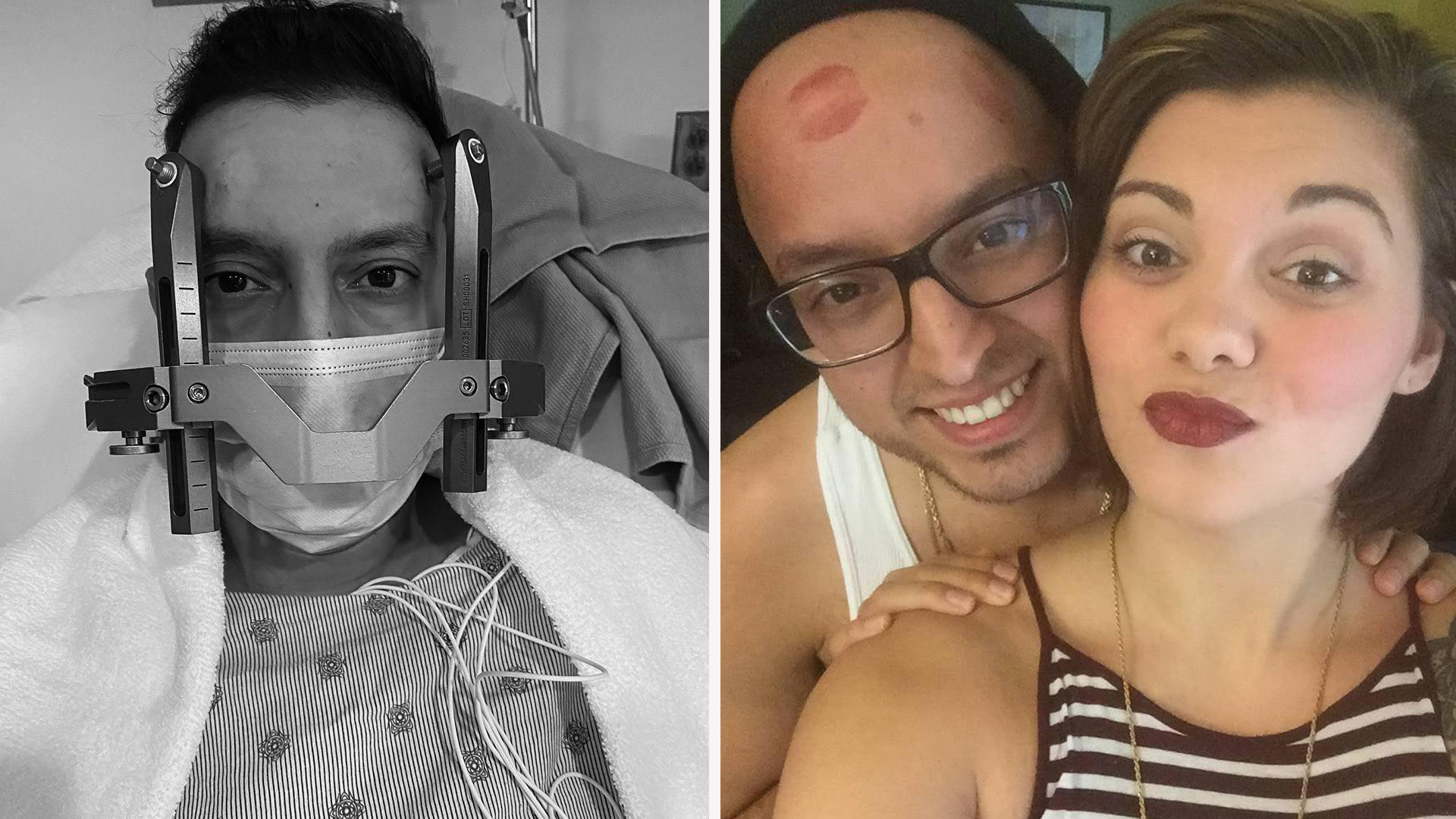 Así es como Israel Lemus logra sobrevivir 6 años tras diagnóstico de ...