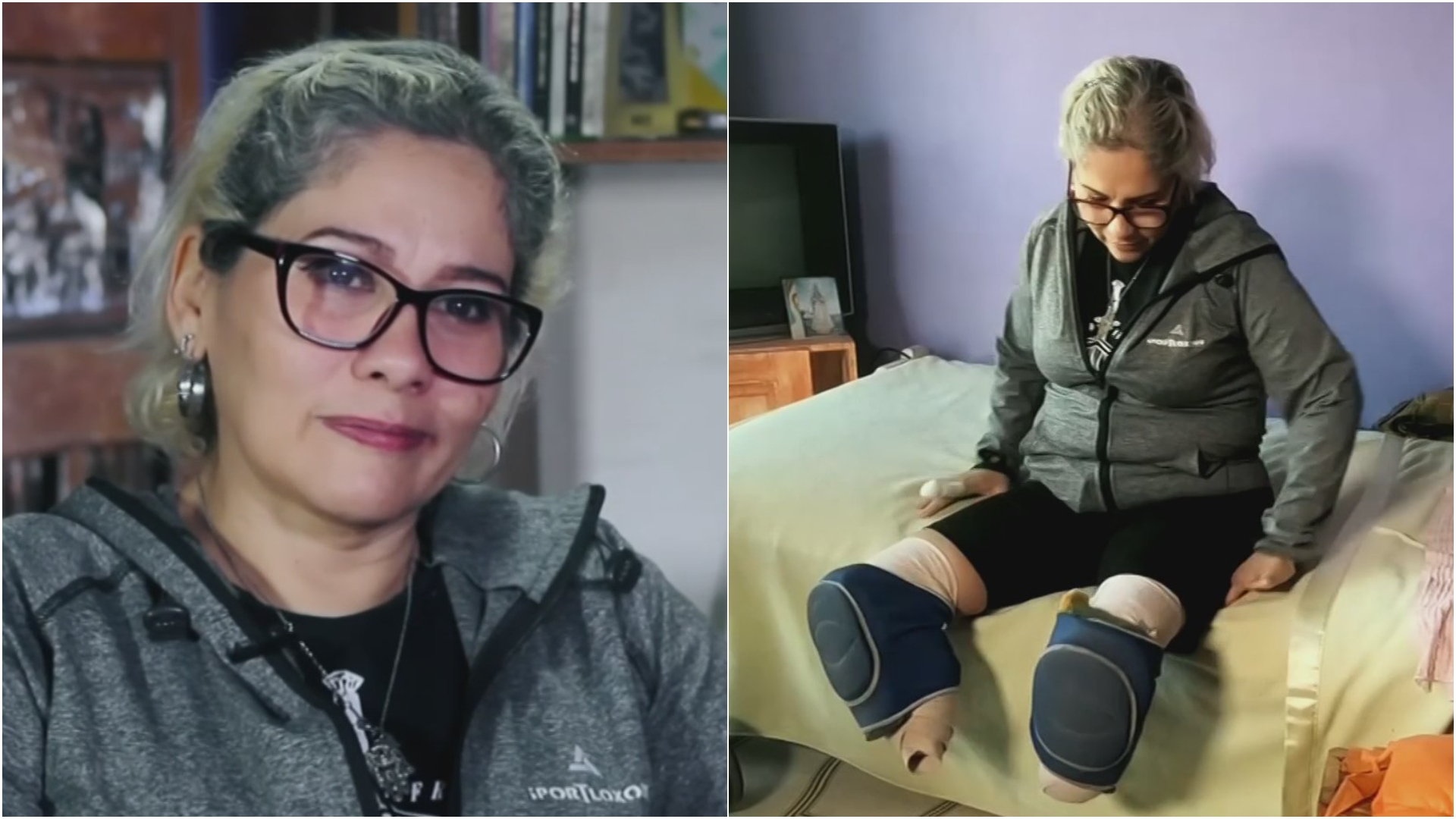 Ayuda de Impacto: Mujer terminó con las piernas amputadas tras ...