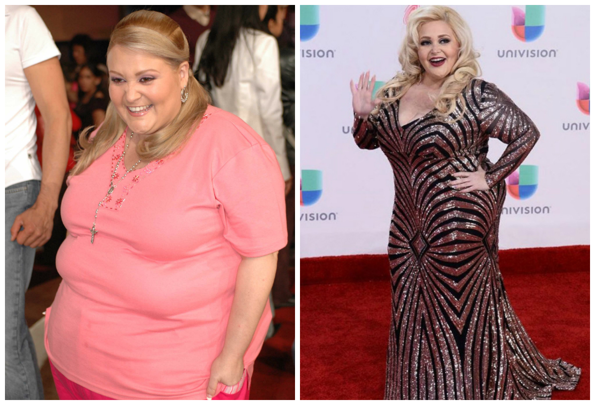 Sheyla bajó de peso, cambió su nariz y sorprendió a todos | Shows ...