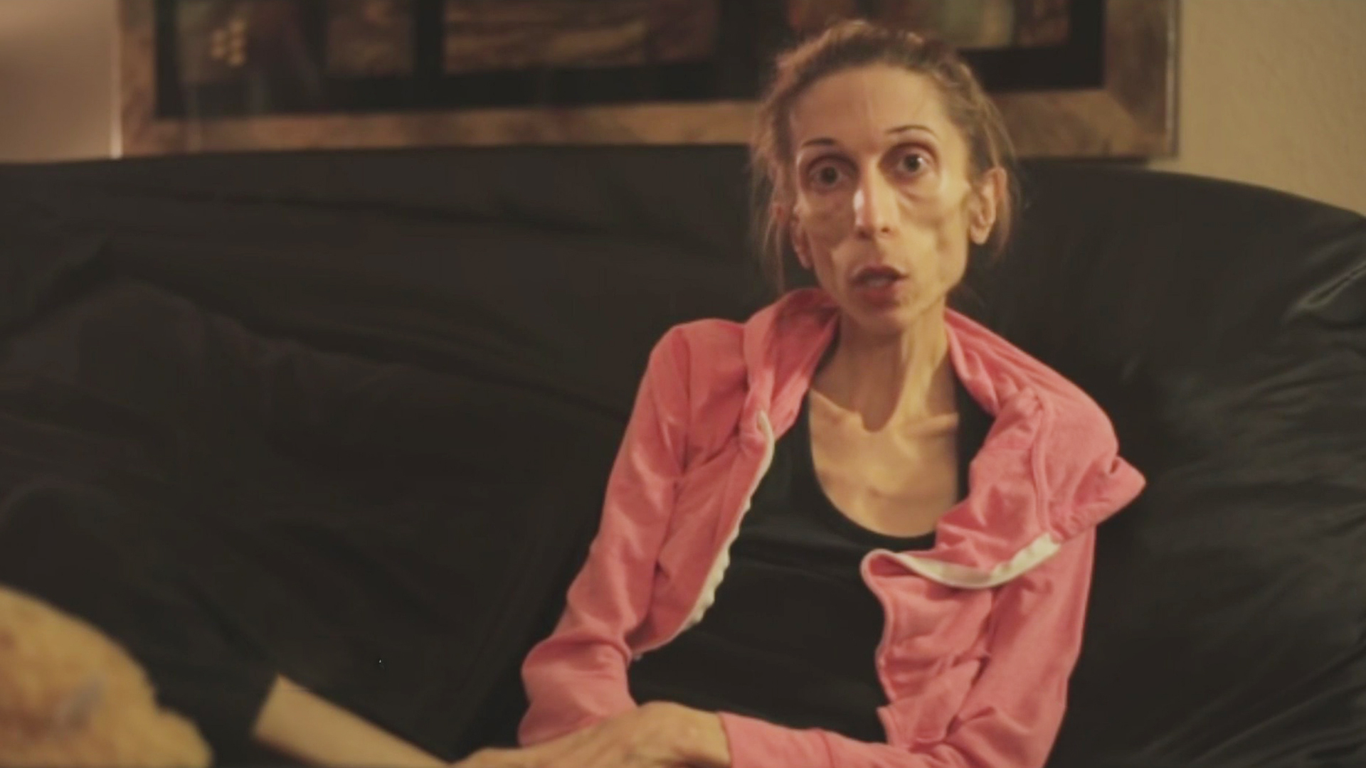 Una mujer con anorexia recurre a internet para pedir ayuda y poder ...