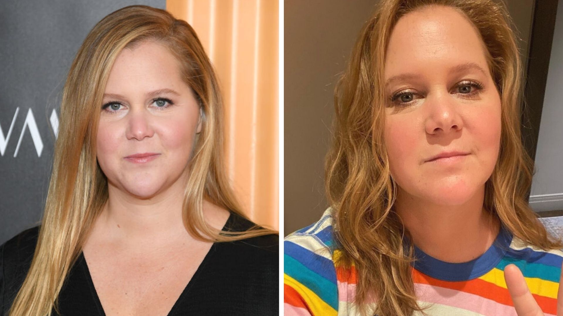 Amy Schumer reveló que se sometió a una liposucción y mostró los ...