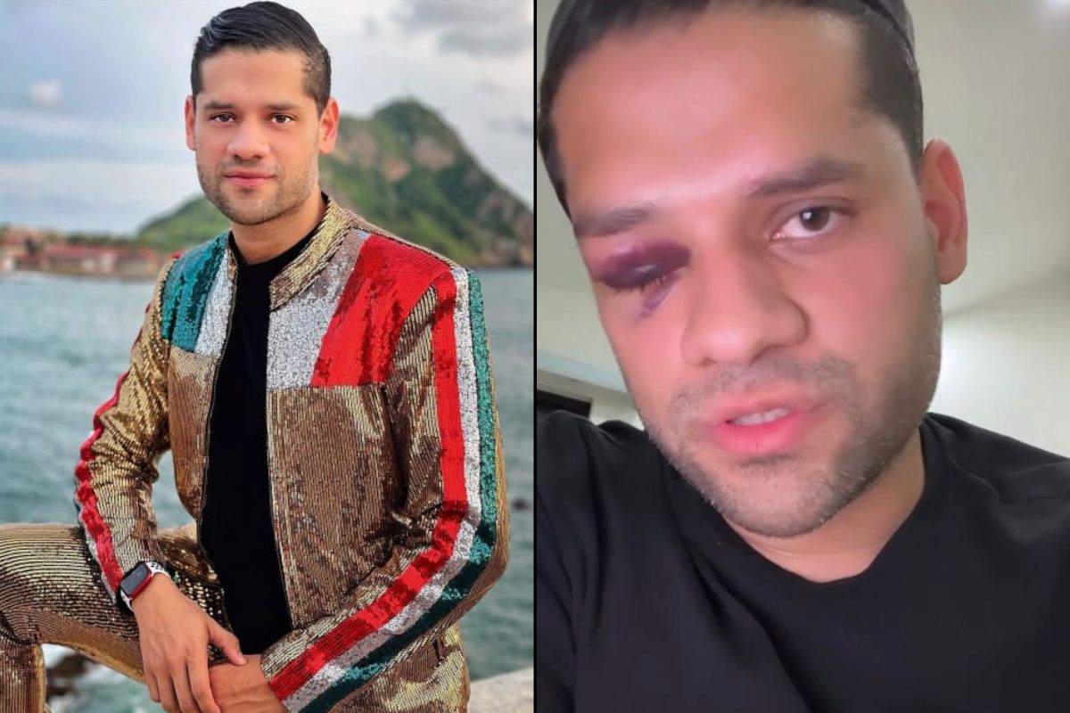 Alan Zamudio de Mi Banda el Mexicano aparece con el ojo morado, ¿qué le ...