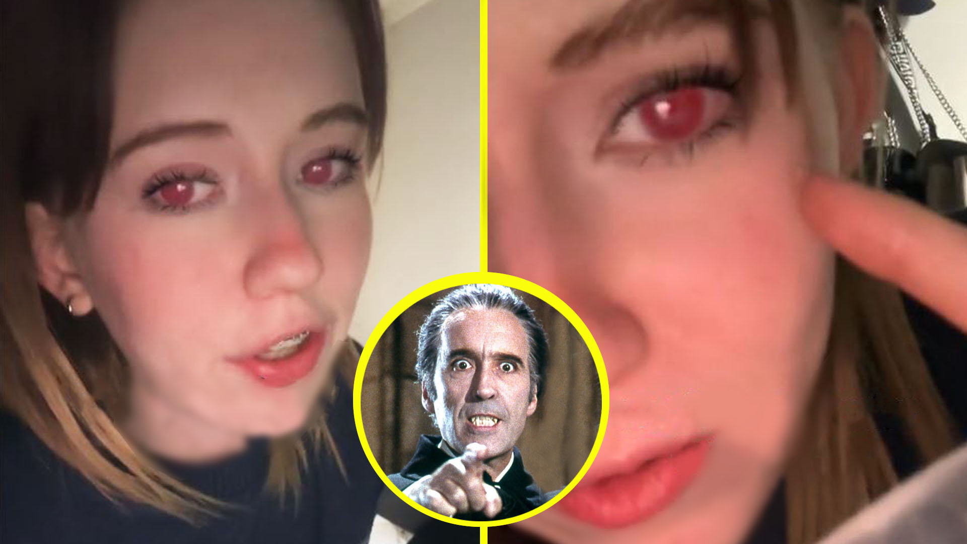 Gente Con Ojos Rojos Existen Los Ojos De Color Rojo? | Blog De