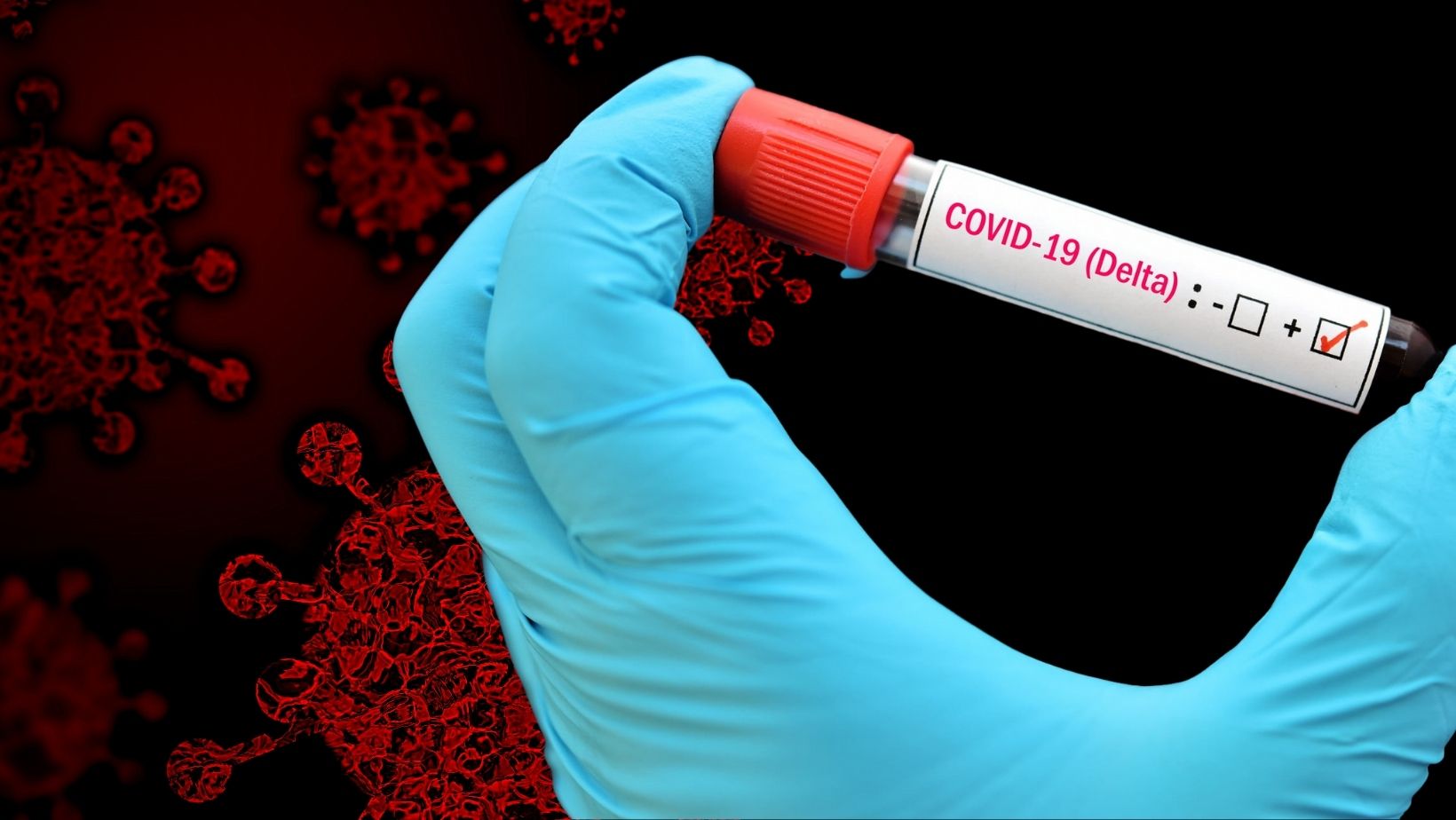 Variante delta plus: Lo que se sabe sobre nueva variante de covid-19 que preocupa a los médicos ...