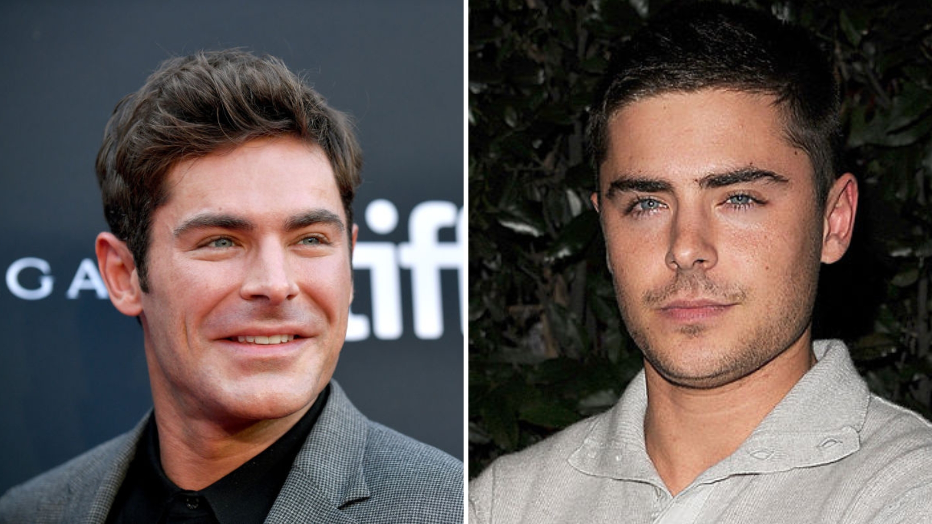 ¿Zac Efron se operó o por qué se ve tan diferente? La supuesta ...