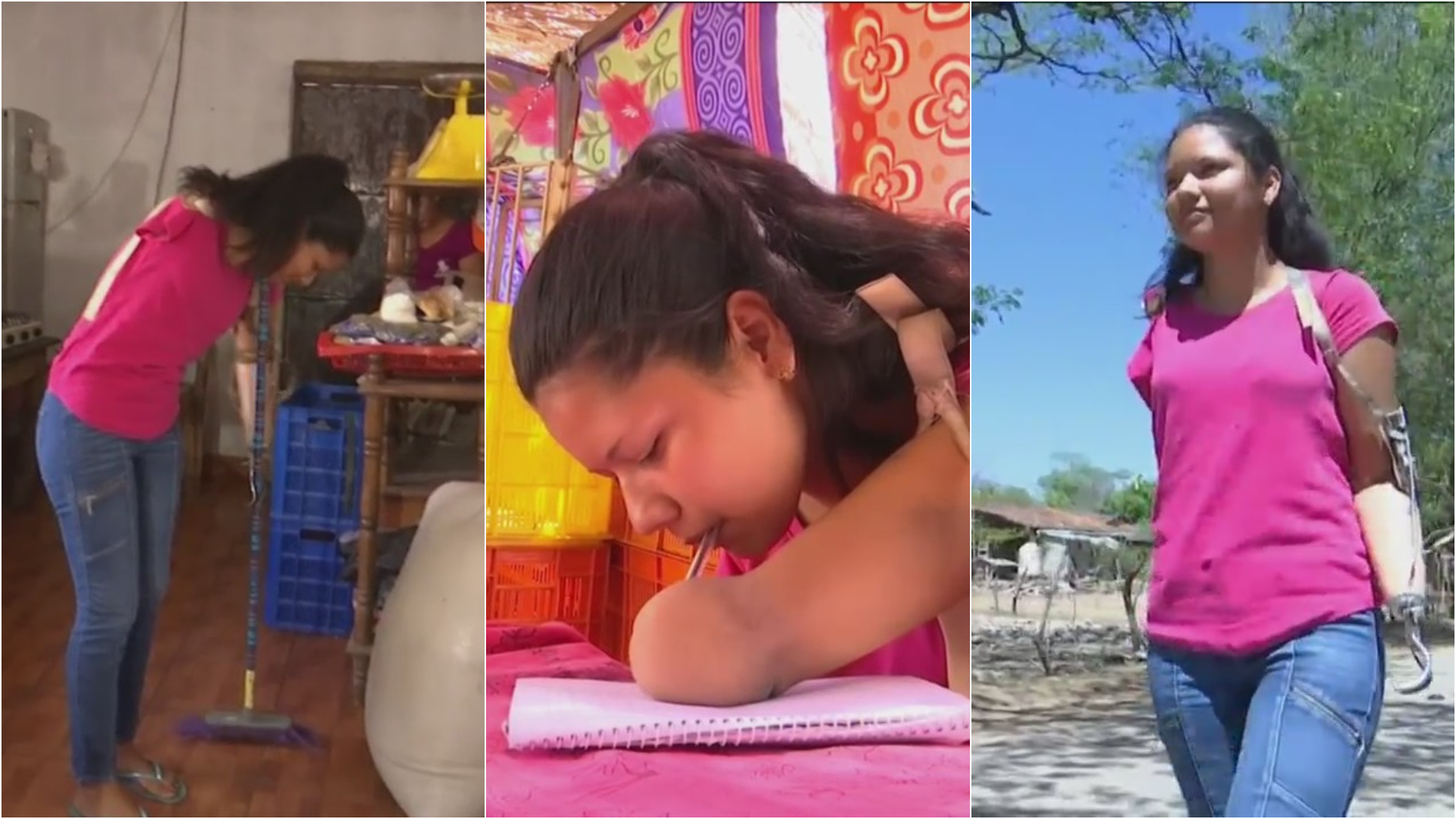 Joven perdió sus brazos en un accidente y necesita ayuda para seguir ...