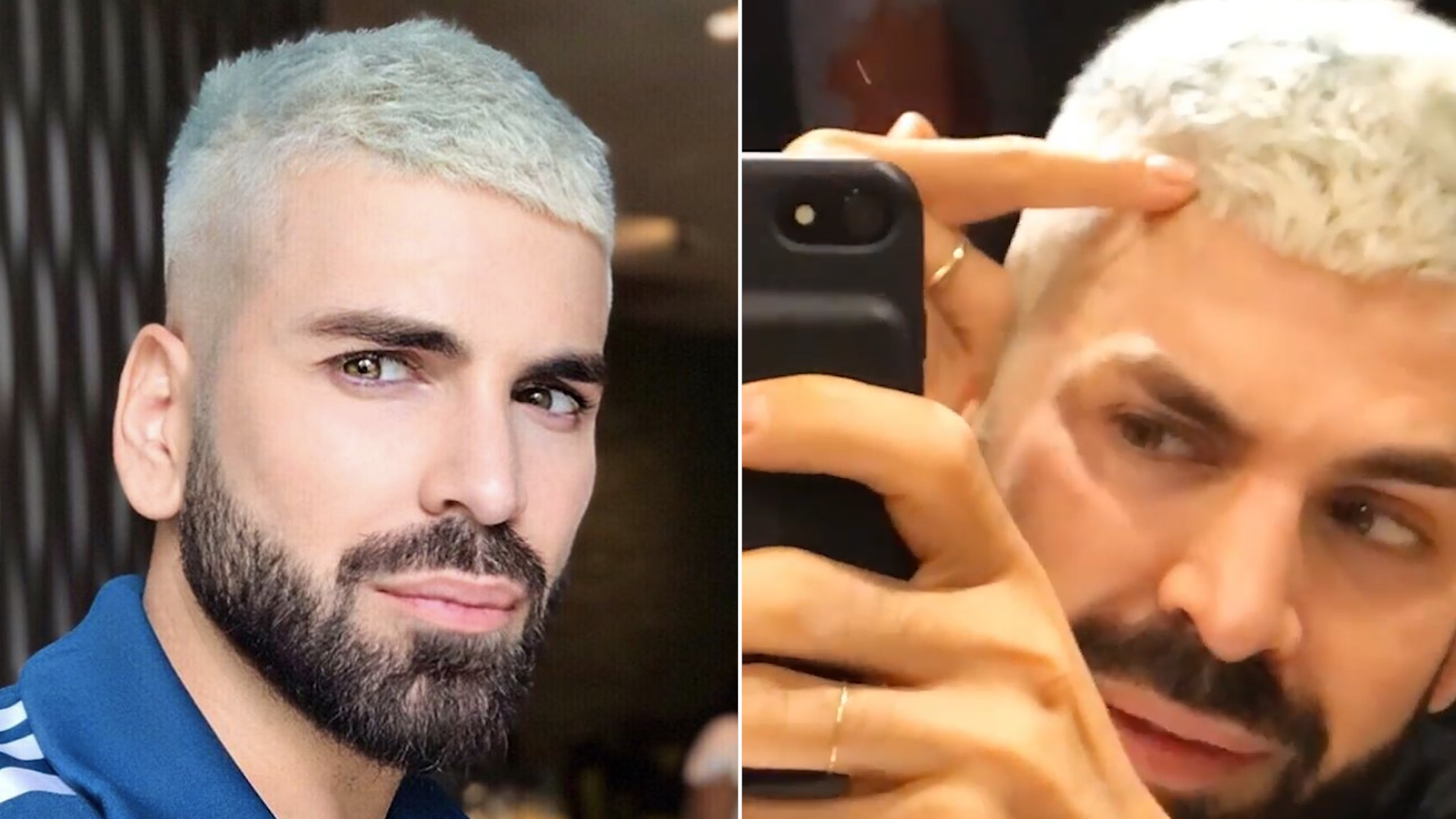 Jomari Goyso le canta a su falta de pelo y le pide a Dios que se lo regrese | Univision Famosos ...