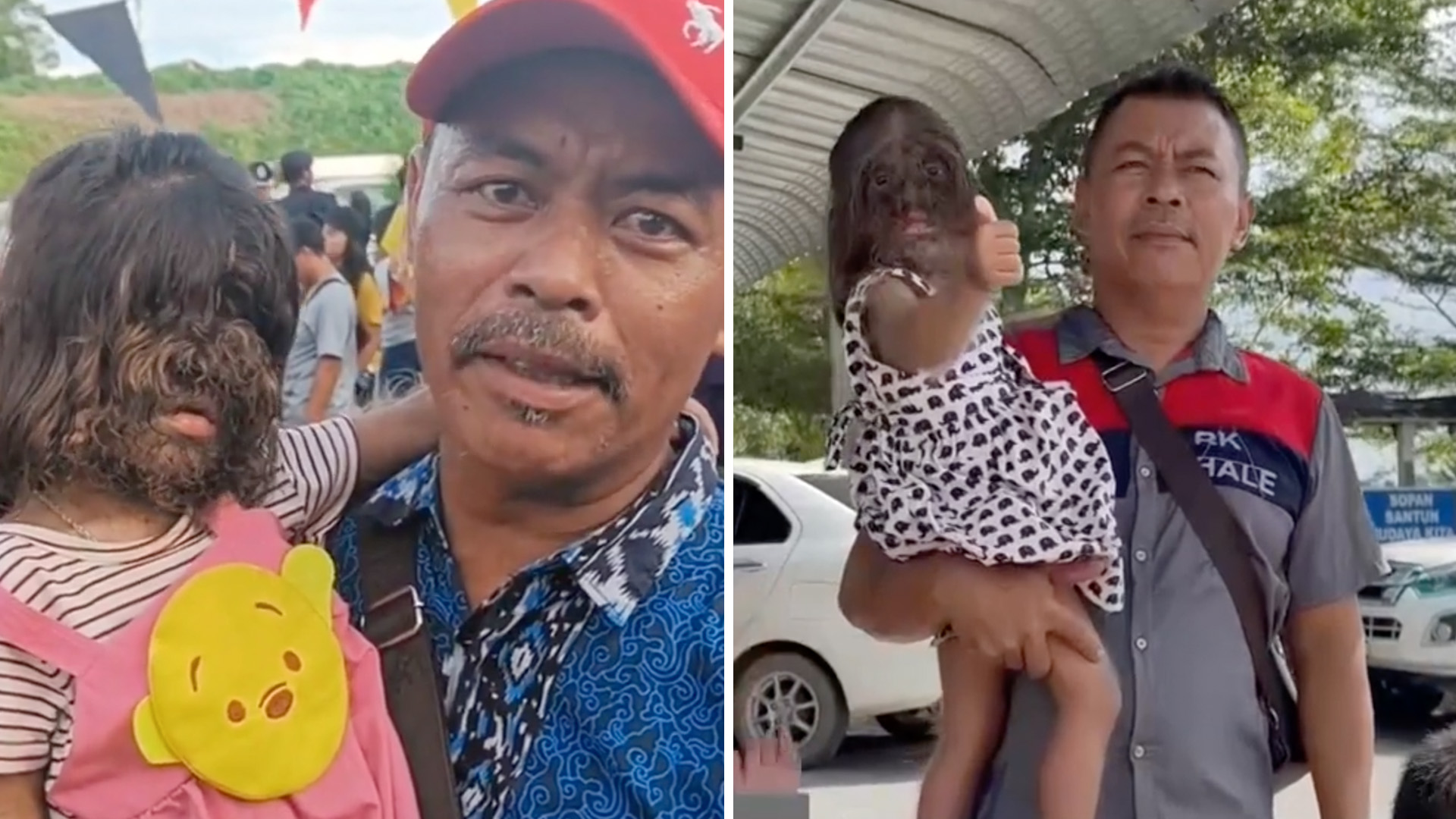 Adik Missclyen: La niña con ‘síndrome de hombre lobo’ que conmueve a ...