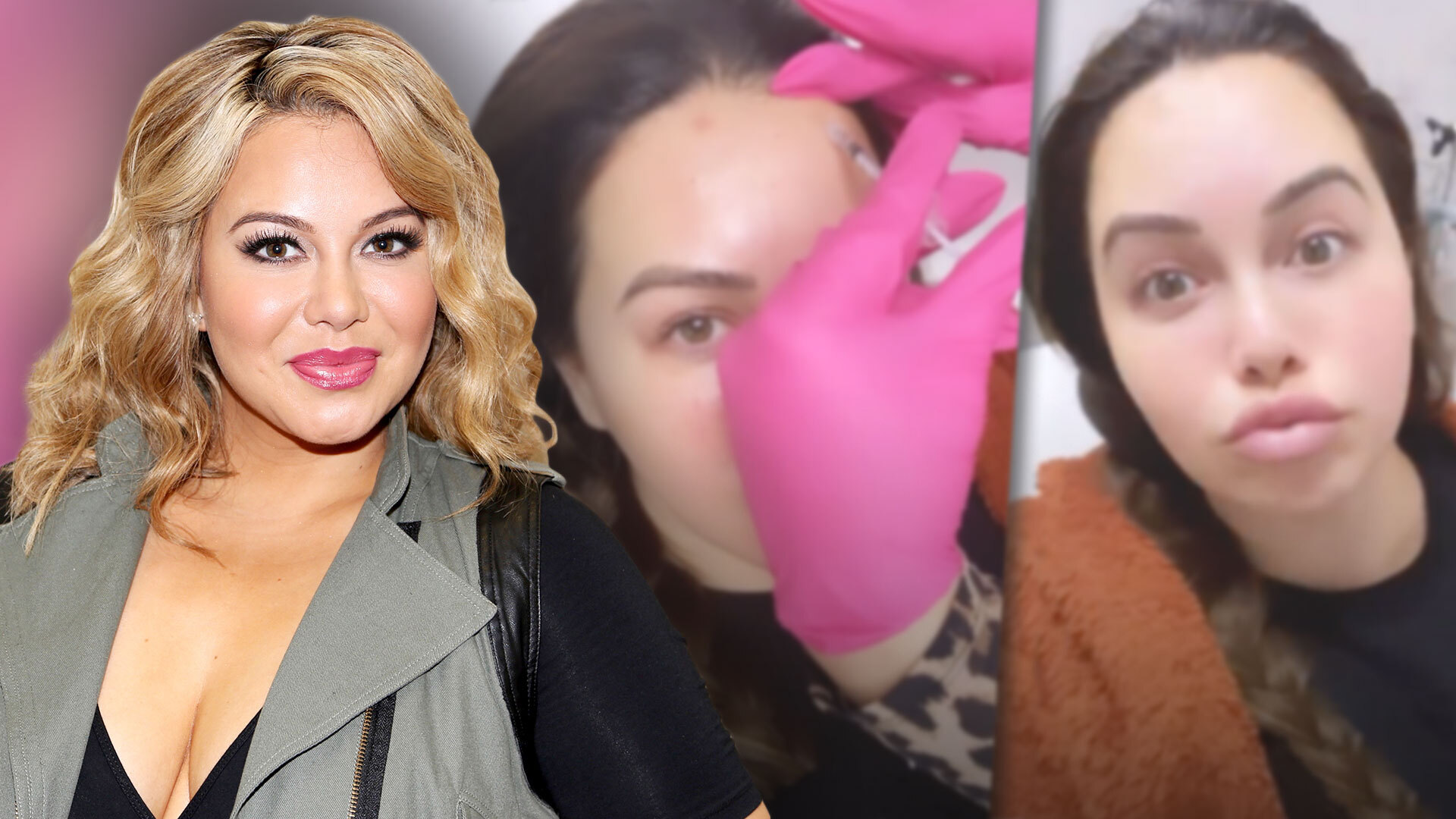 Chiquis Rivera se inyectó bótox para levantar la ceja (este es su ...
