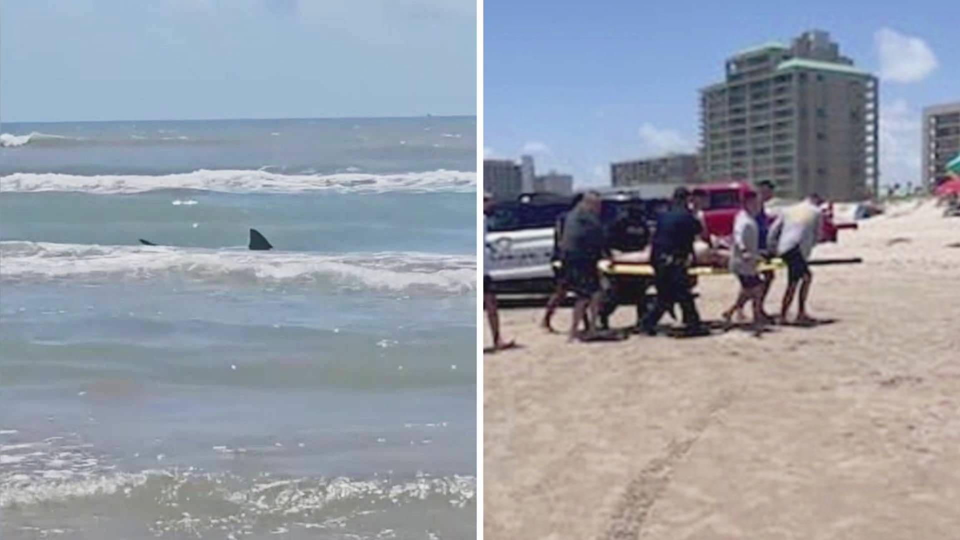 Dos mujeres entre las víctimas del ataque de un tiburón en South Padre ...