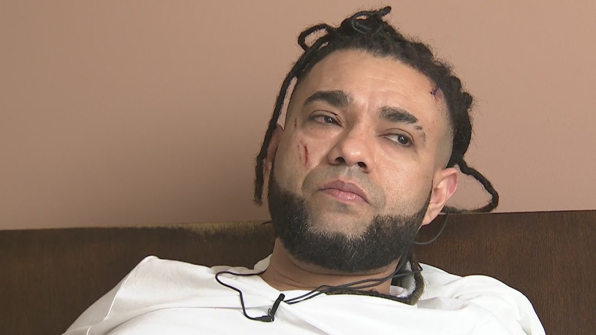 El cantante 'Mala Fe' sobrevive a un ataque con cuchillo en el Alto ...