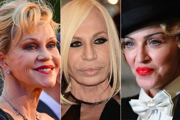 #TBT Famosas antes y después del botox | Univision Famosos | Univision