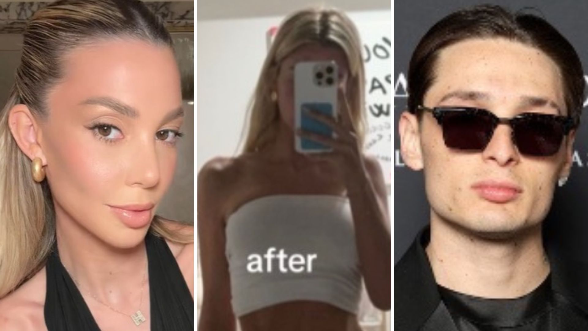 Exnovia de Peso Pluma muestra cambio físico y moretones en las rodillas ...