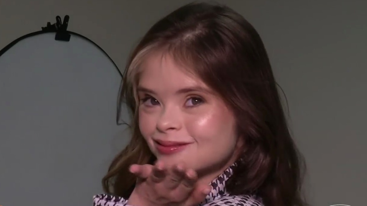 Joven venezolana con síndrome de Down roba corazones y conquista ...