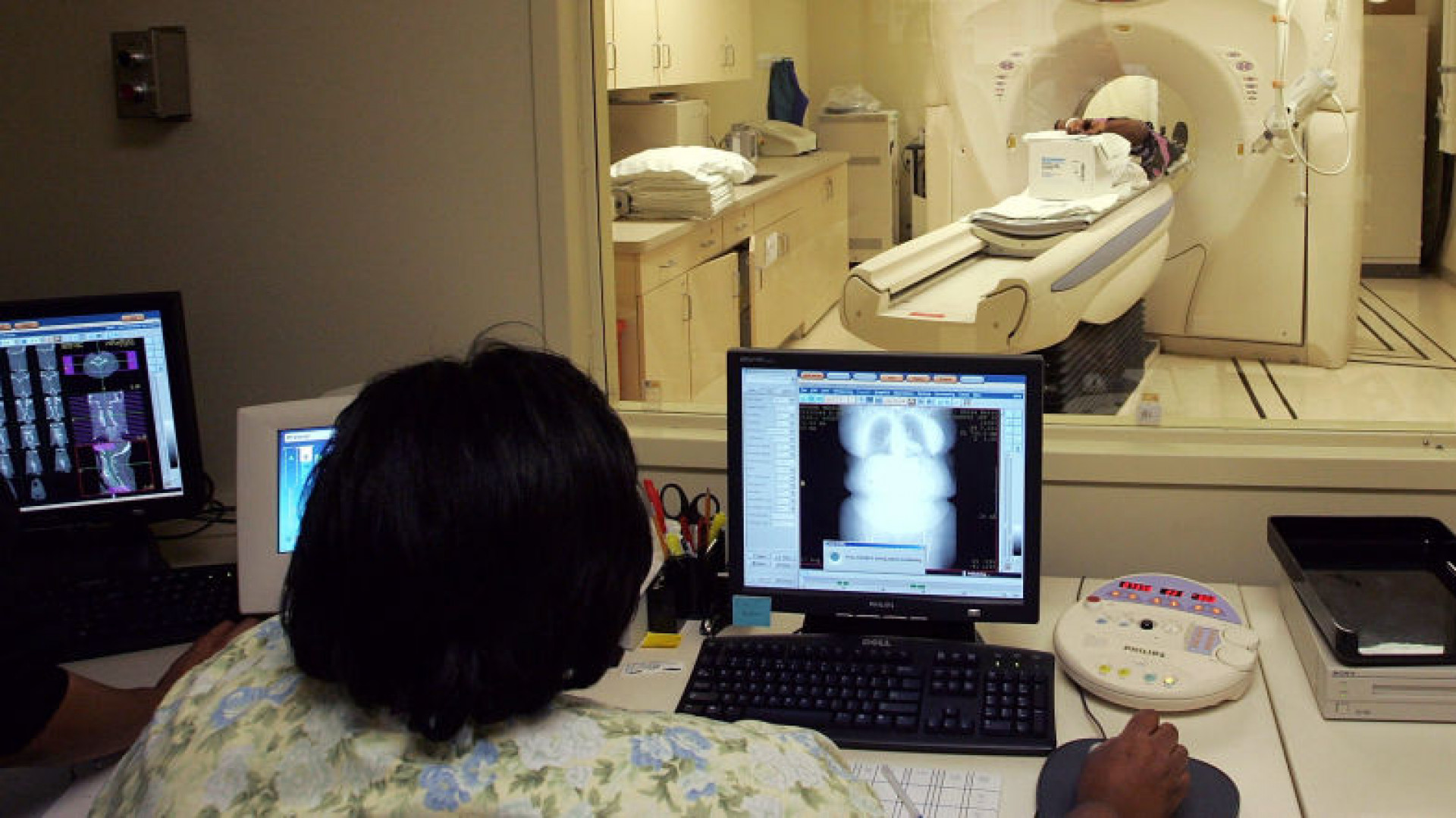 Tócate para que no te toque: la importancia de la detección temprana en ...