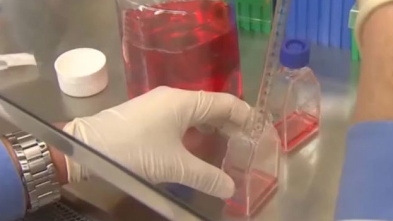 Expertos dan consejos para prevenir el contagio de paperas | Video ...