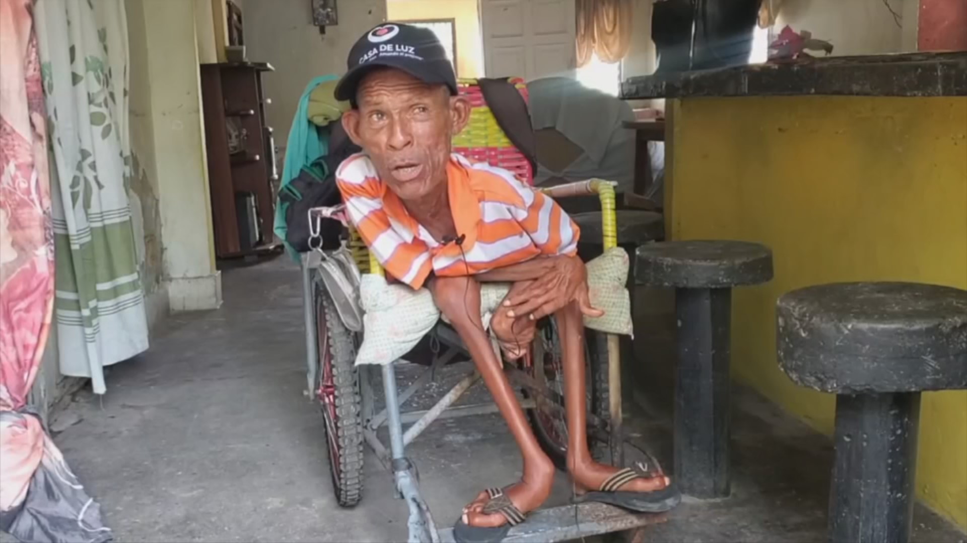 Este hombre lucha día a día con las secuelas de la poliomielitis; pero ...