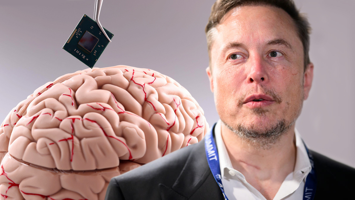 Elon Musk busca voluntarios para probar chip cerebral en humanos ...