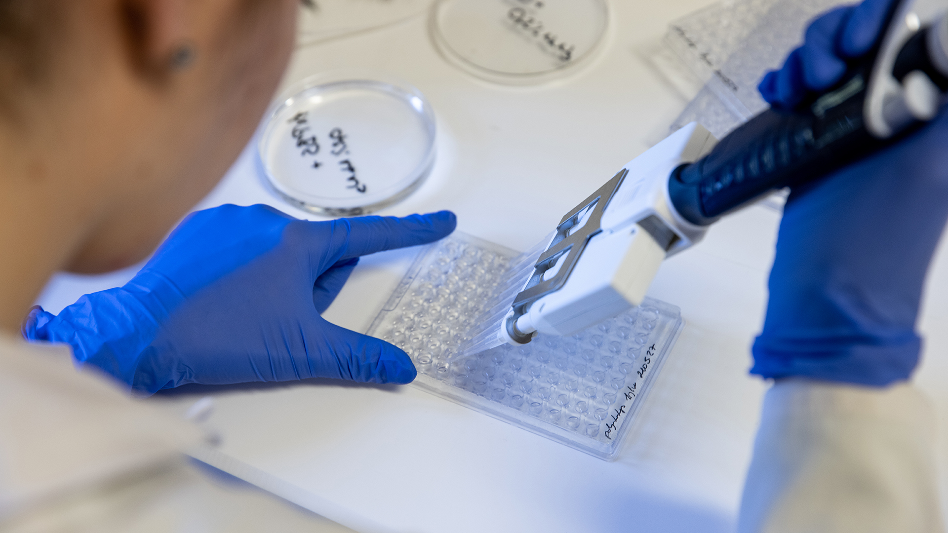 Un experto explica las posibles diferencias entre la variante omicron ...