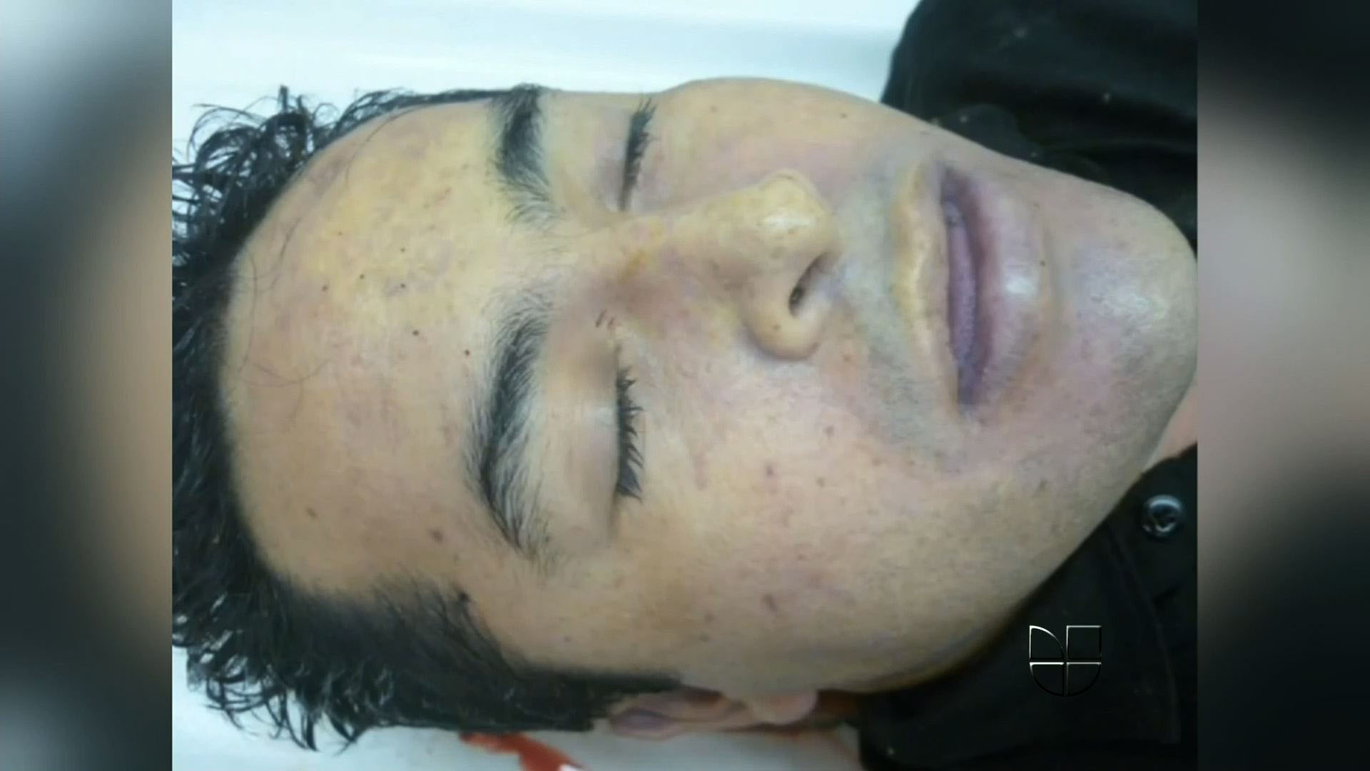 'El Lazca' se cosió las orejas para cambiar su apariencia | Noticias ...