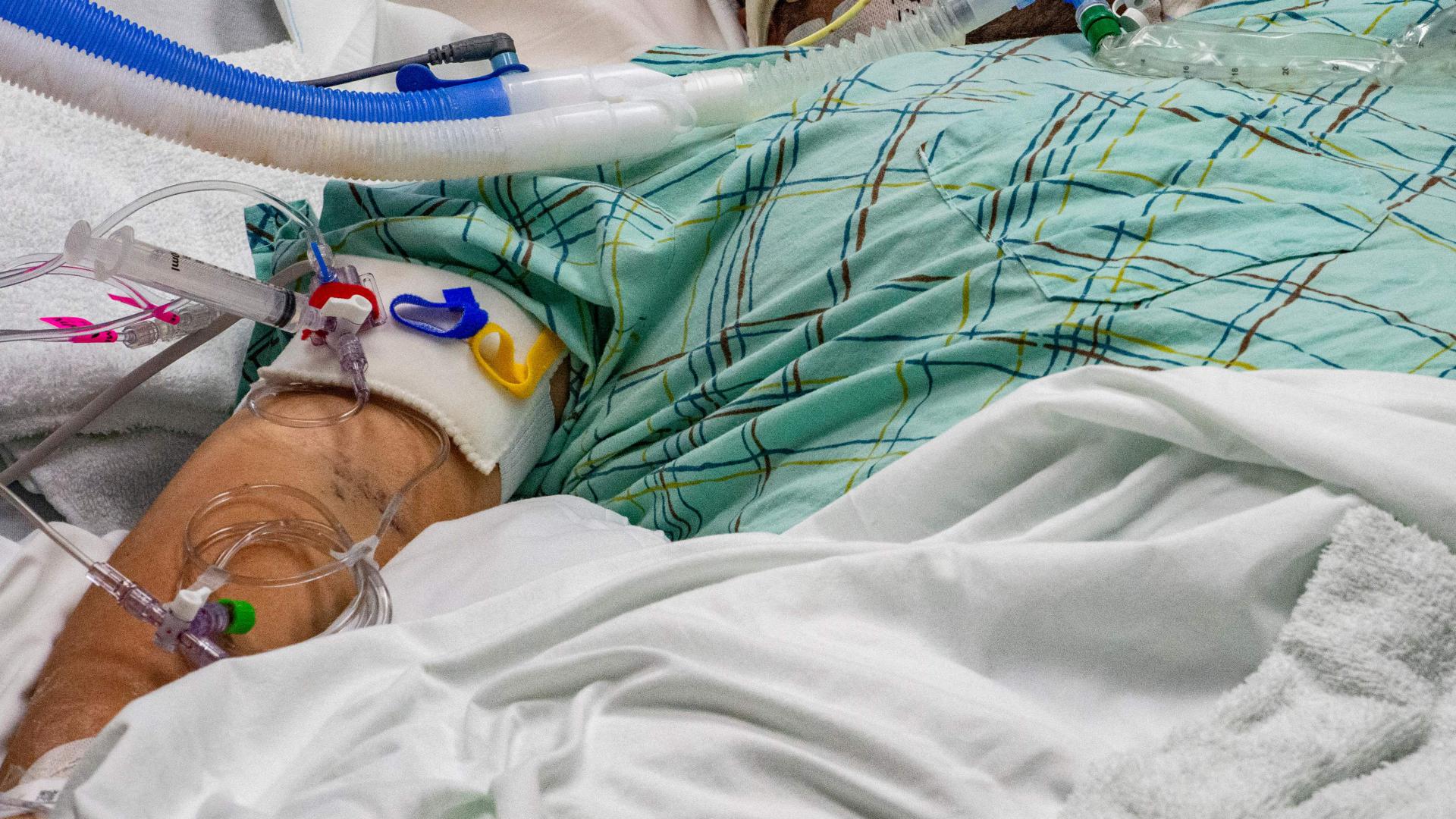 Preocupación mundial por la bacteria del estreptococo A: conoce qué ...