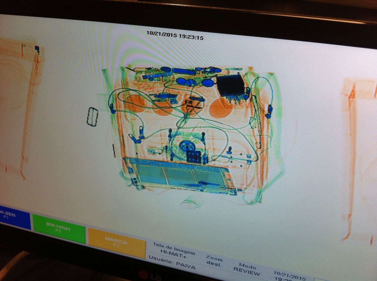 El increíble rescate de un halcón desde el escáner de rayos X de un ...