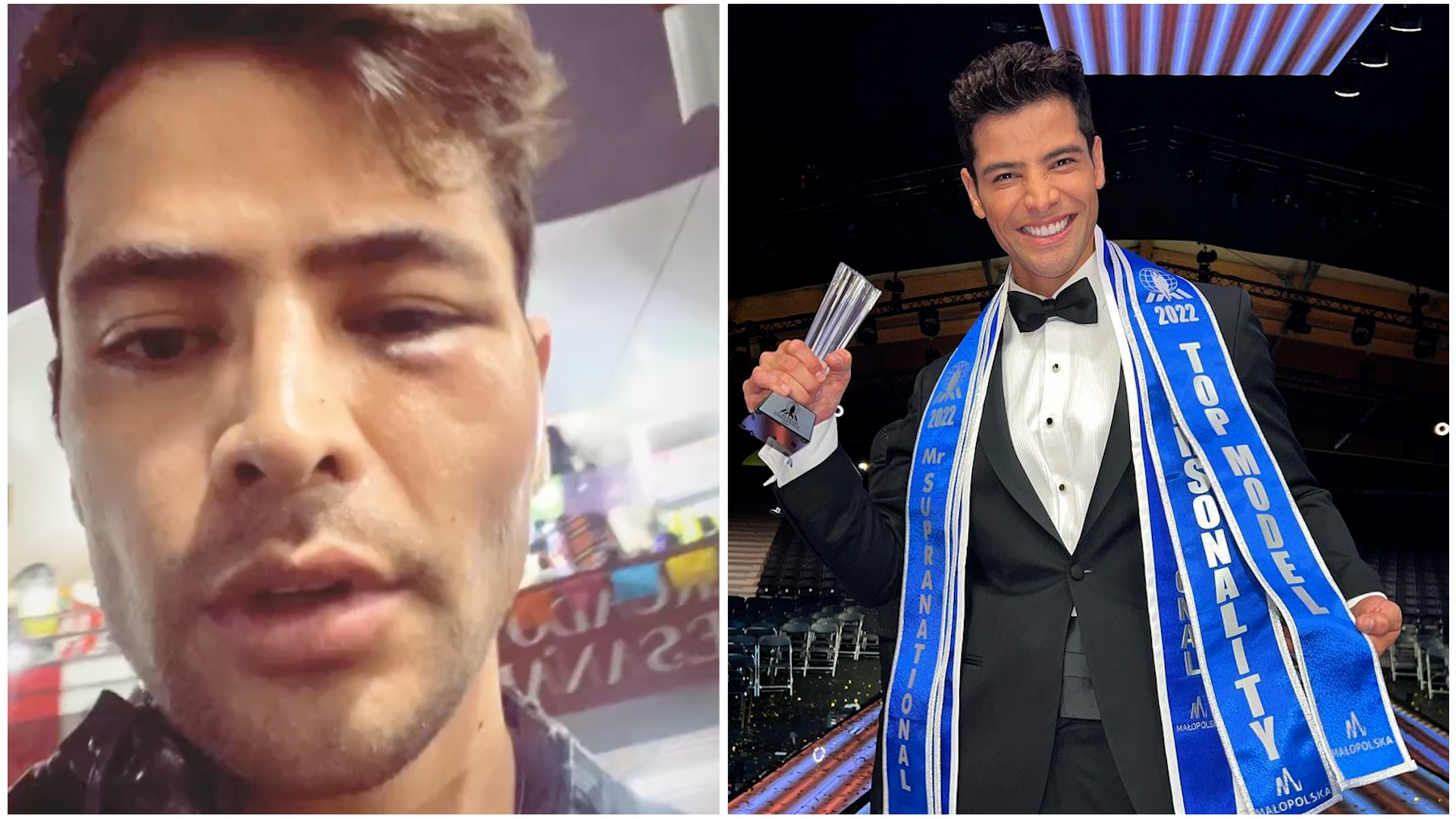 Le parten el rostro a actor de La Rosa de Guadalupe que fue escogido el ...