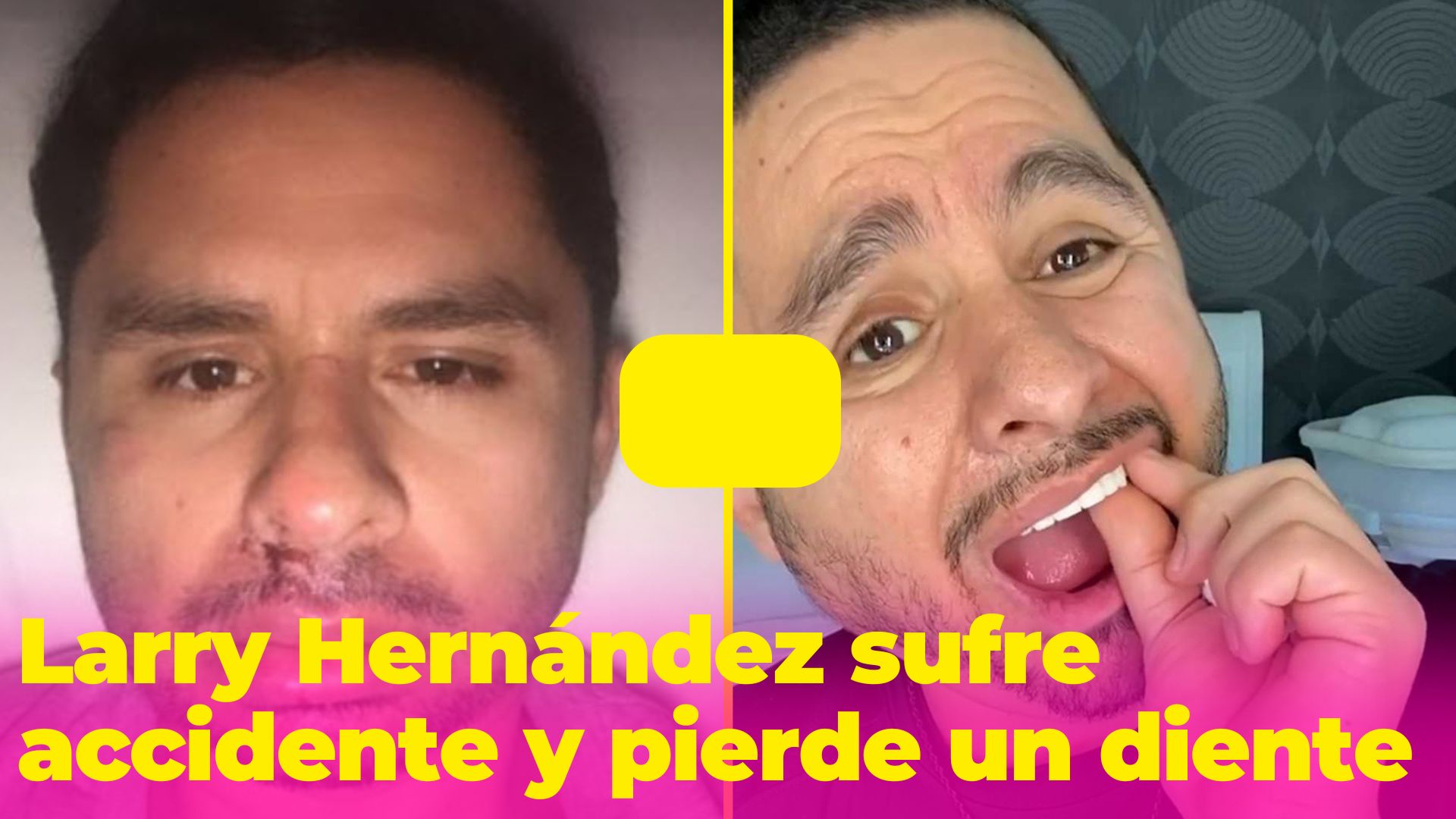 Larry Hernández vuelve a sufrir un accidente y pierde uno de sus ...