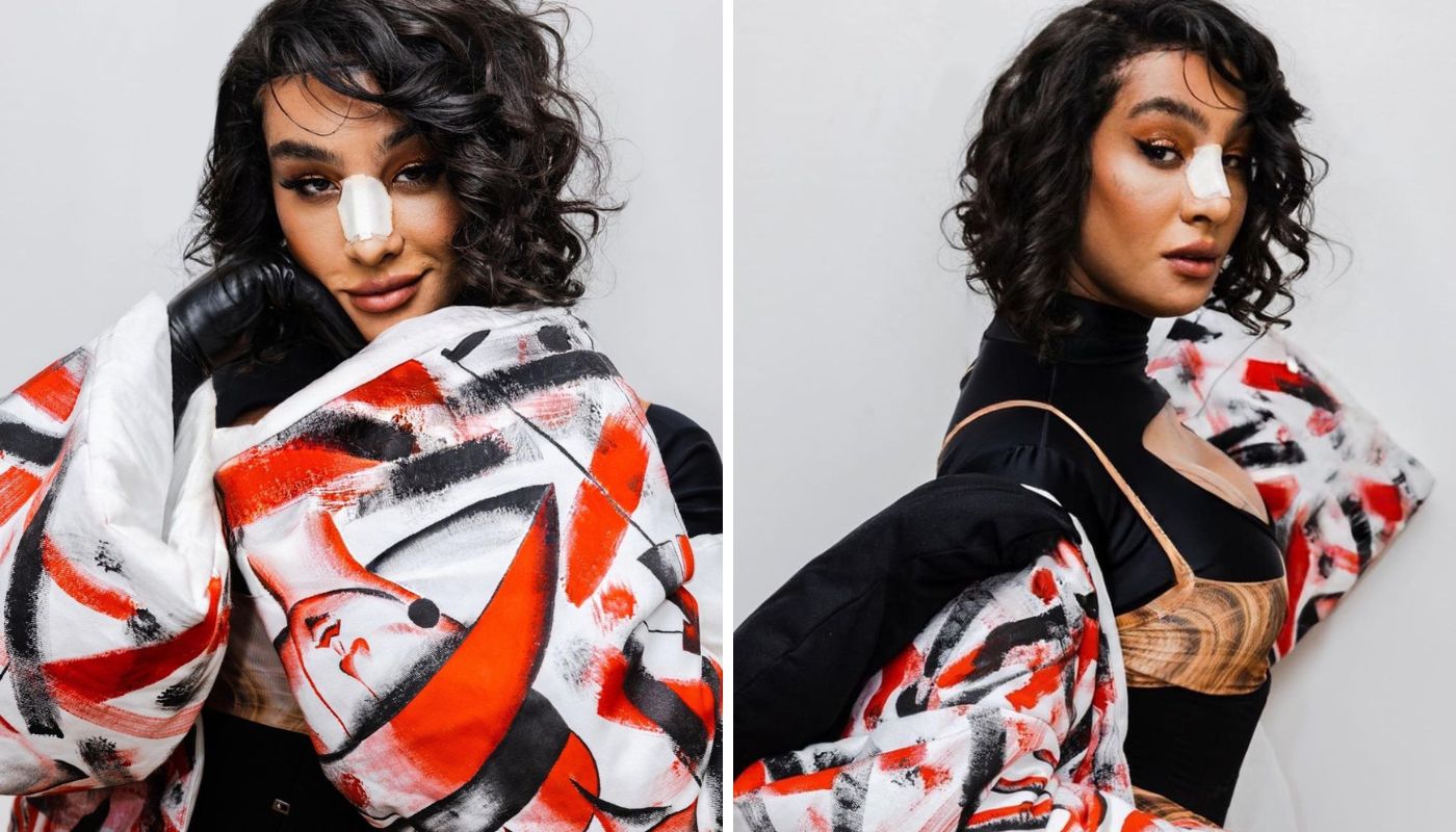 Cirurgias de modificações corporais de Lina podem ser múltiplas e ...