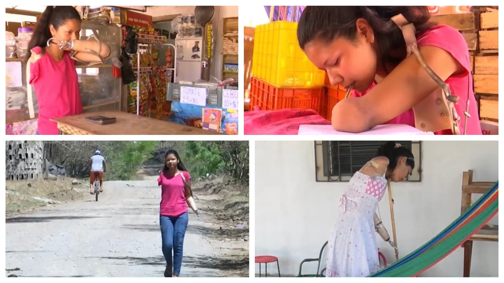 Joven que perdió sus dos brazos sueña con ser psicóloga para ayudar a ...