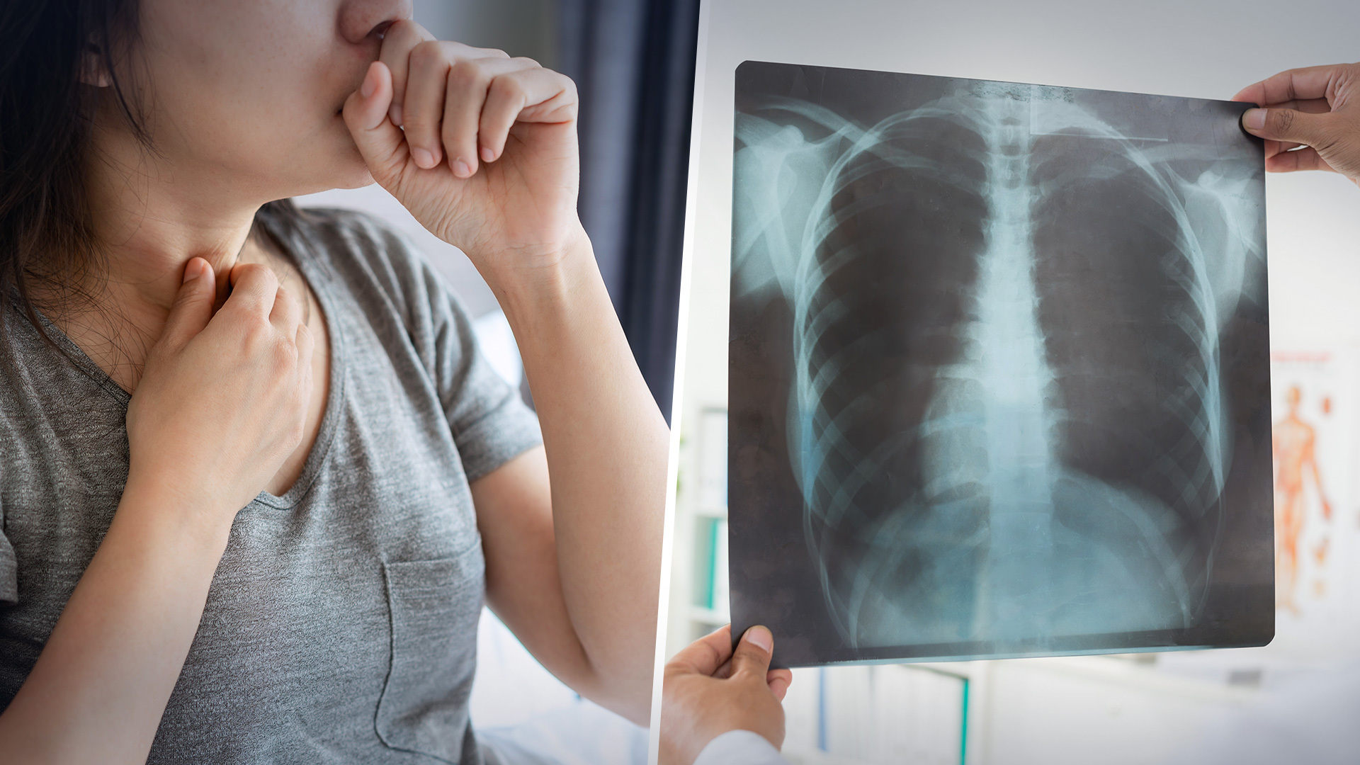 “La tos no es mala": Experto nos aclara cuándo es necesario acudir al ...