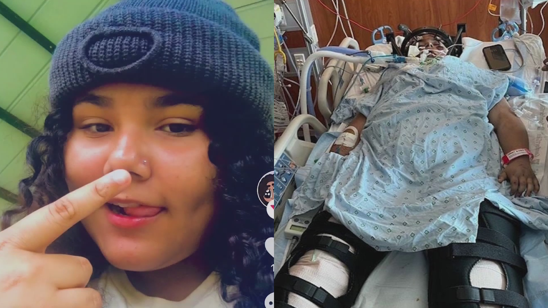 ¿Cómo avanza el caso de Sonia Sánchez, joven arrollada en su scooter ...