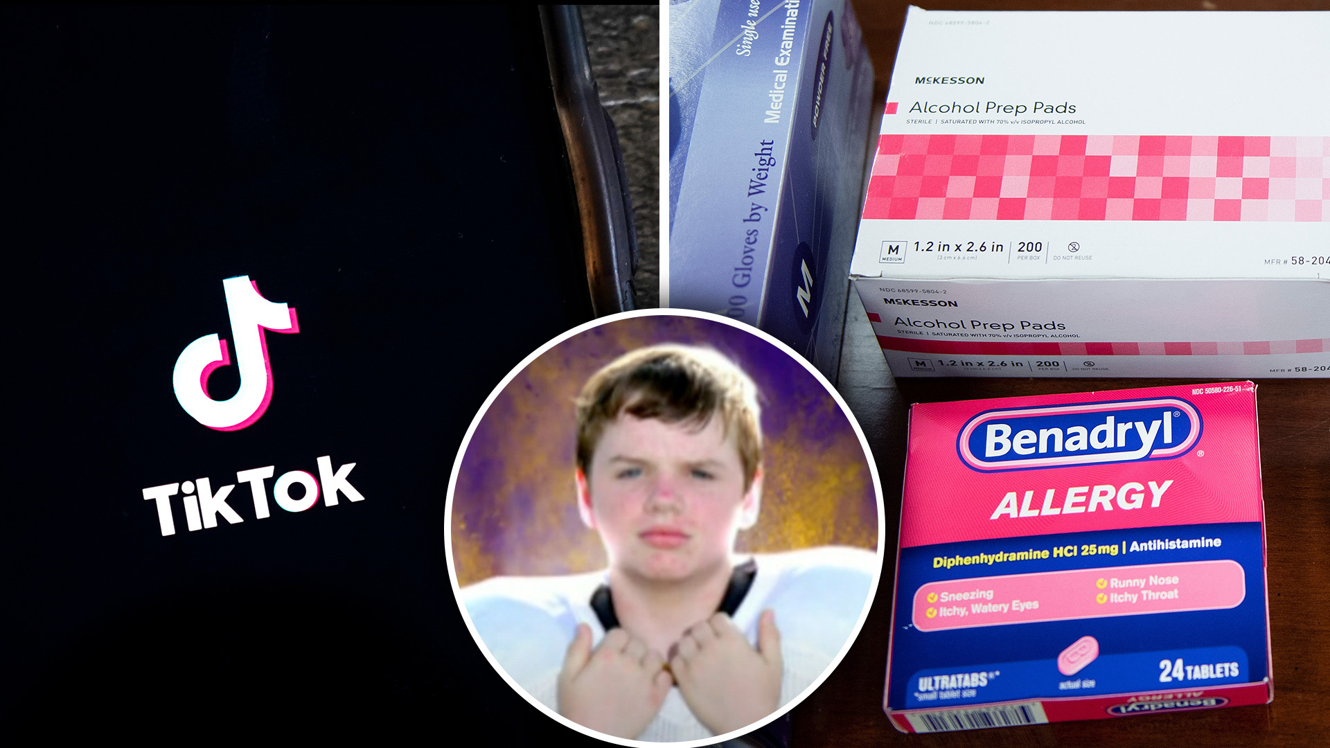 Benadryl Challenge: Conoce el reto de TikTok entre adolescentes para ...