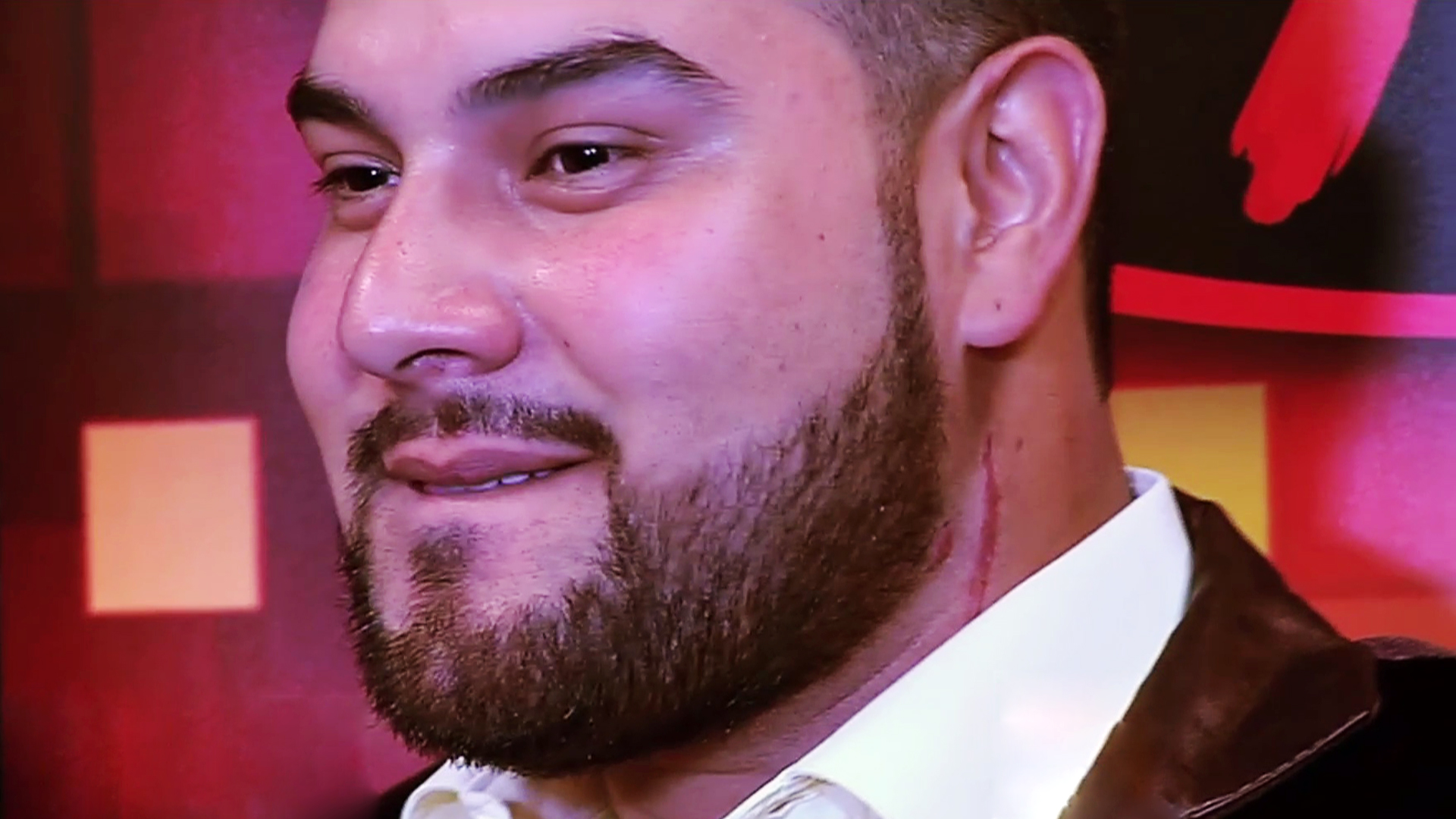 Mostró su cicatriz: Alan Ramírez regresó a los escenarios luego de ser ...