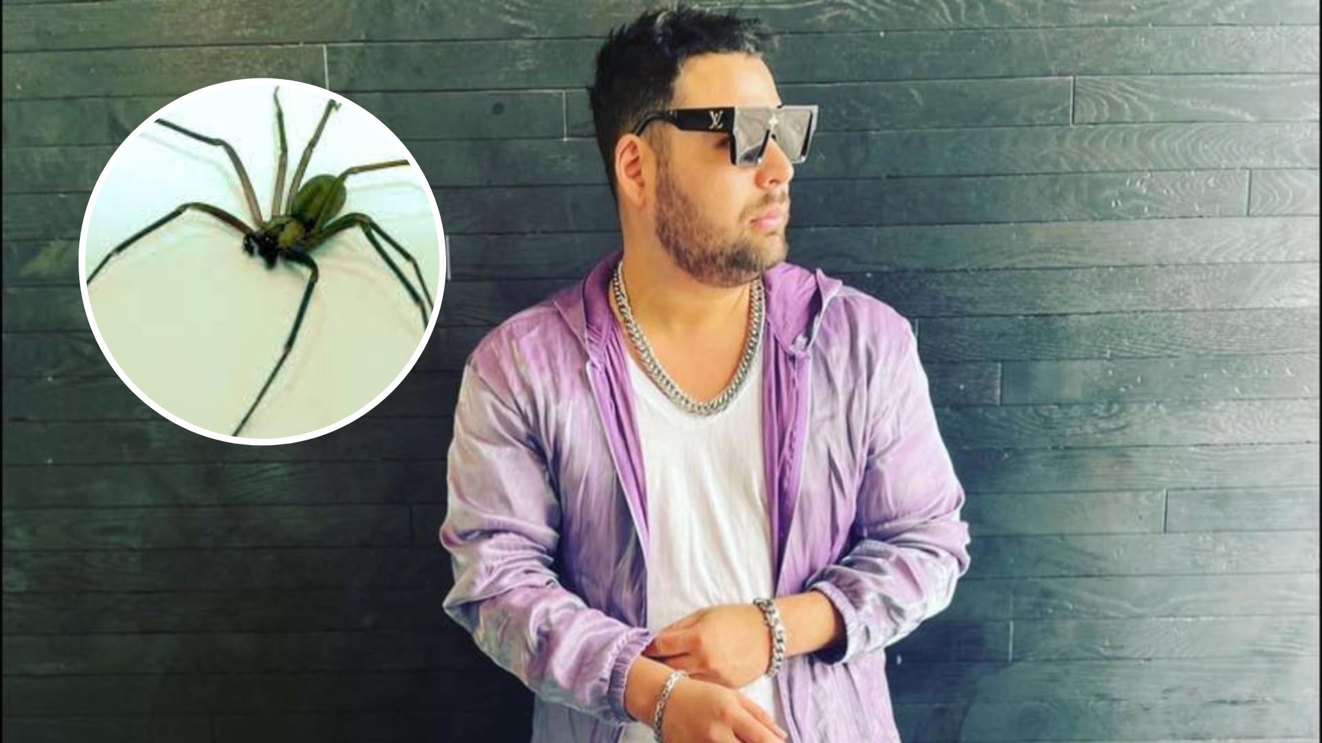 Gabe Lustman, cantante de Atlanta casi pierde la pierna tras picadura de araña reclusa ...