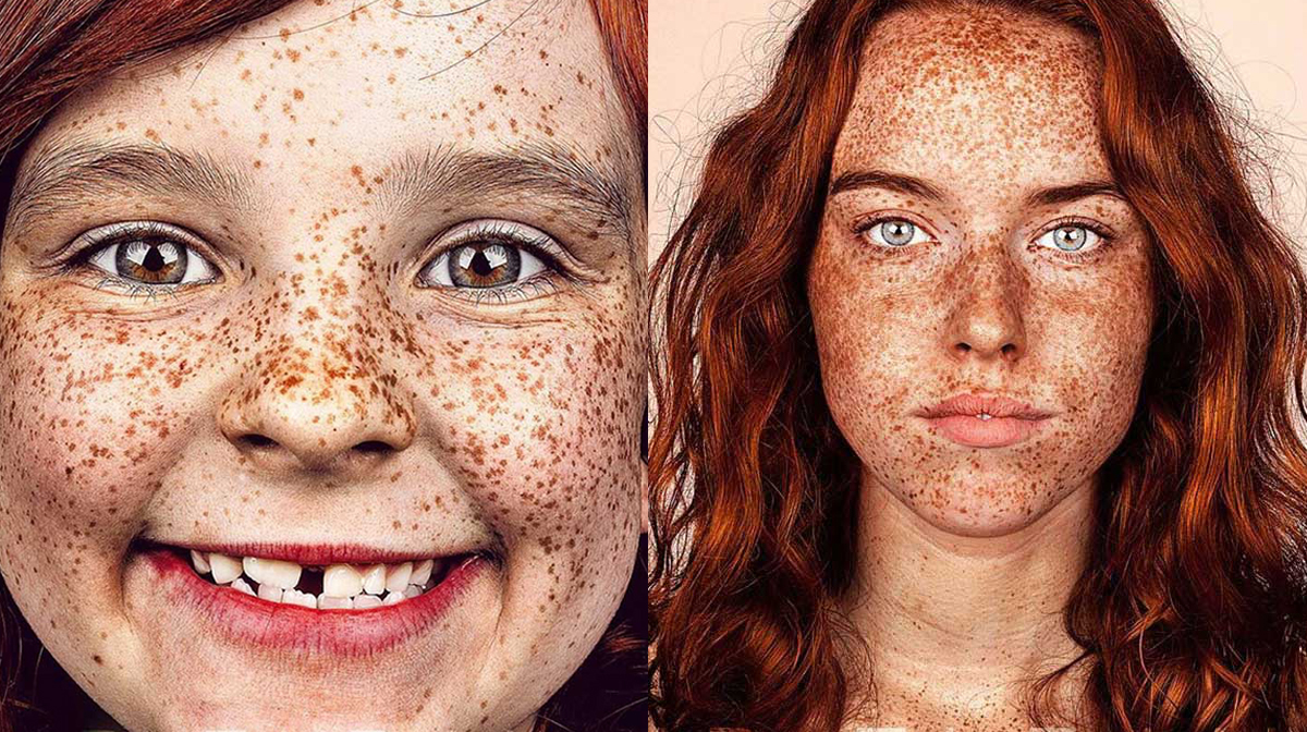 Recorrió el mundo para mostrar la belleza de las pecas. | Estilo de ...