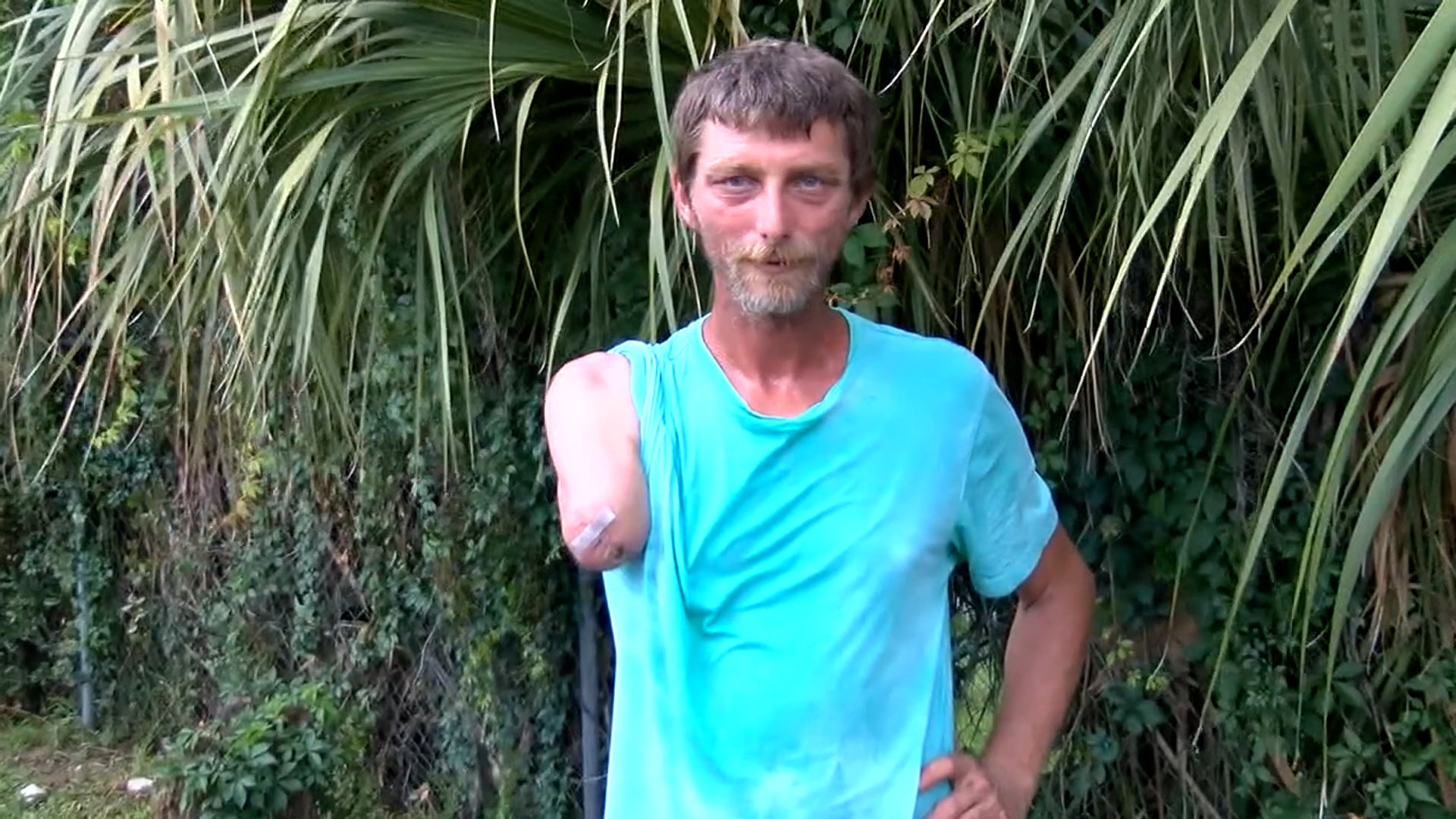 Cuenta cómo sobrevivió, luego que perdió su brazo en el ataque de un ...