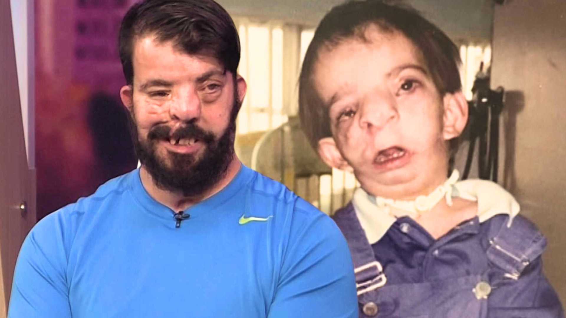 Superó el rechazo de sus padres y da un ejemplo de amor: la historia de ...