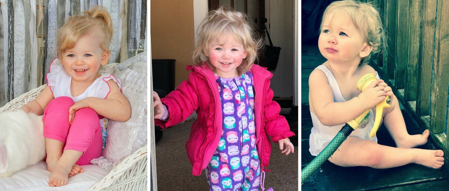 Conoce la historia de Ivy, la pequeña que es alérgica al agua ...