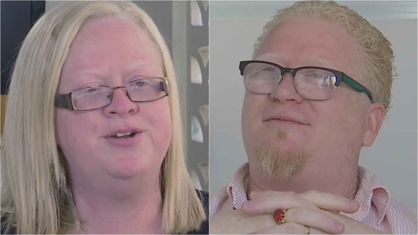 ¿Cómo es ser albino en un país tan soleado como Puerto Rico? | Shows ...