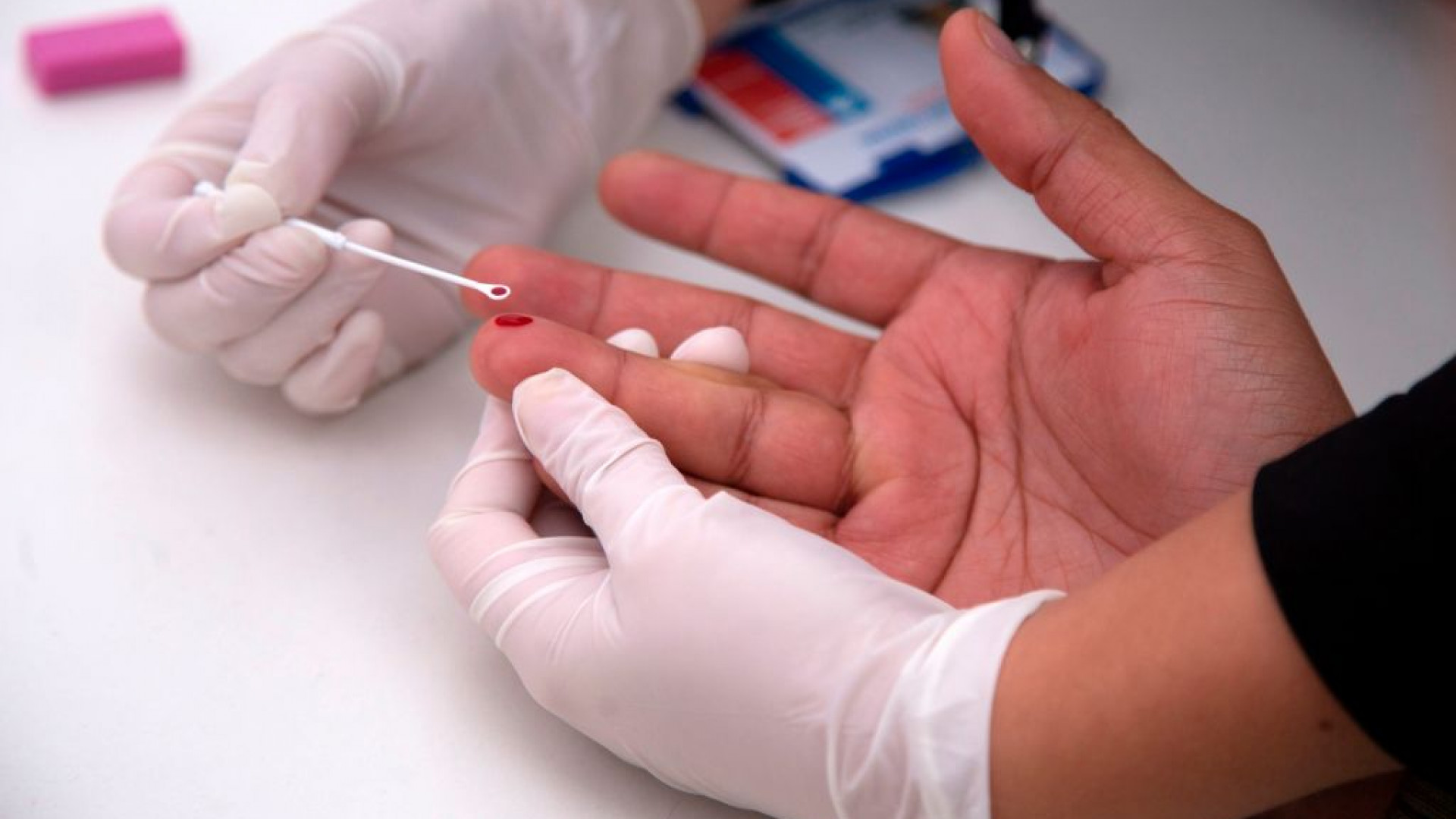 Especialista dice que la mujer curada de VIH sin tratamiento es una ...