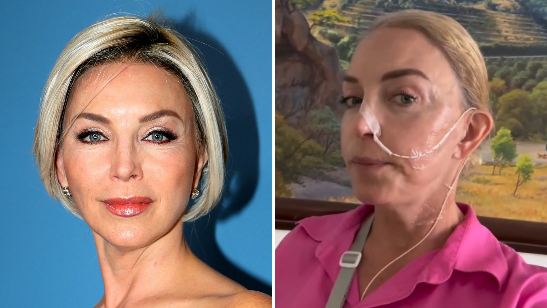 Laura Flores revela cómo está su salud tras microinfarto y cirugía: “Me duele” | Univision ...