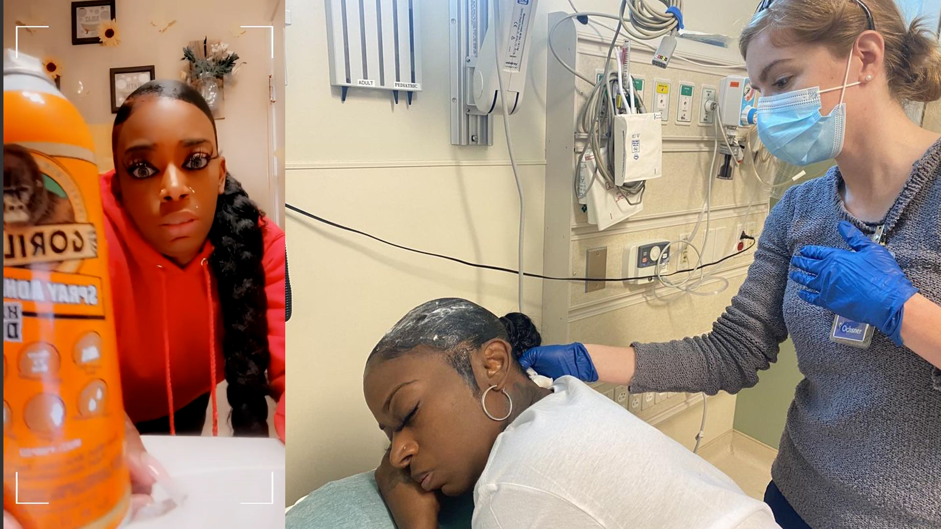 Mujer lamenta usar pegamento en el cabello porque se le acabó la laca ...