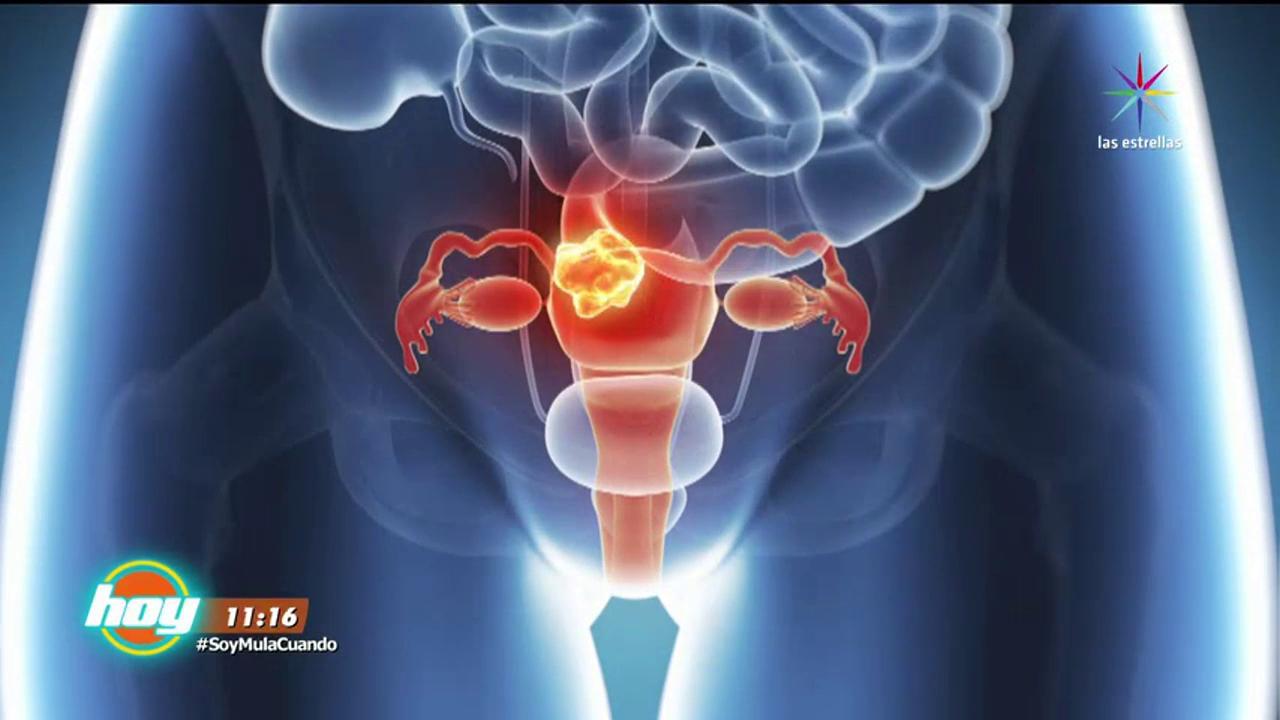 ¿Quitar la matriz? Checa los mitos que existen | Shows Hoy | Las Estrellas