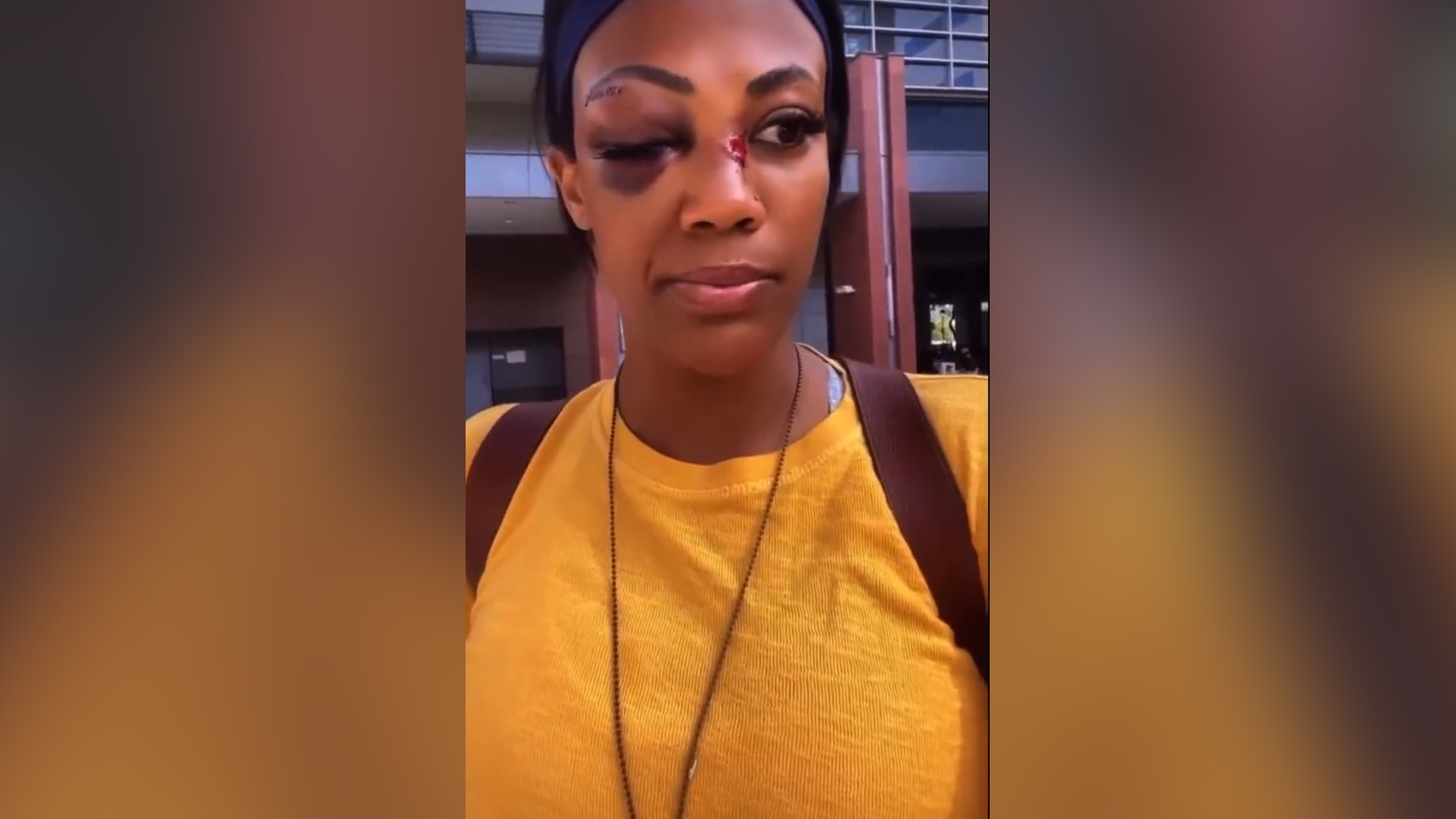 La medallista olímpica Kim Glass relata cómo un extraño le fracturó la ...