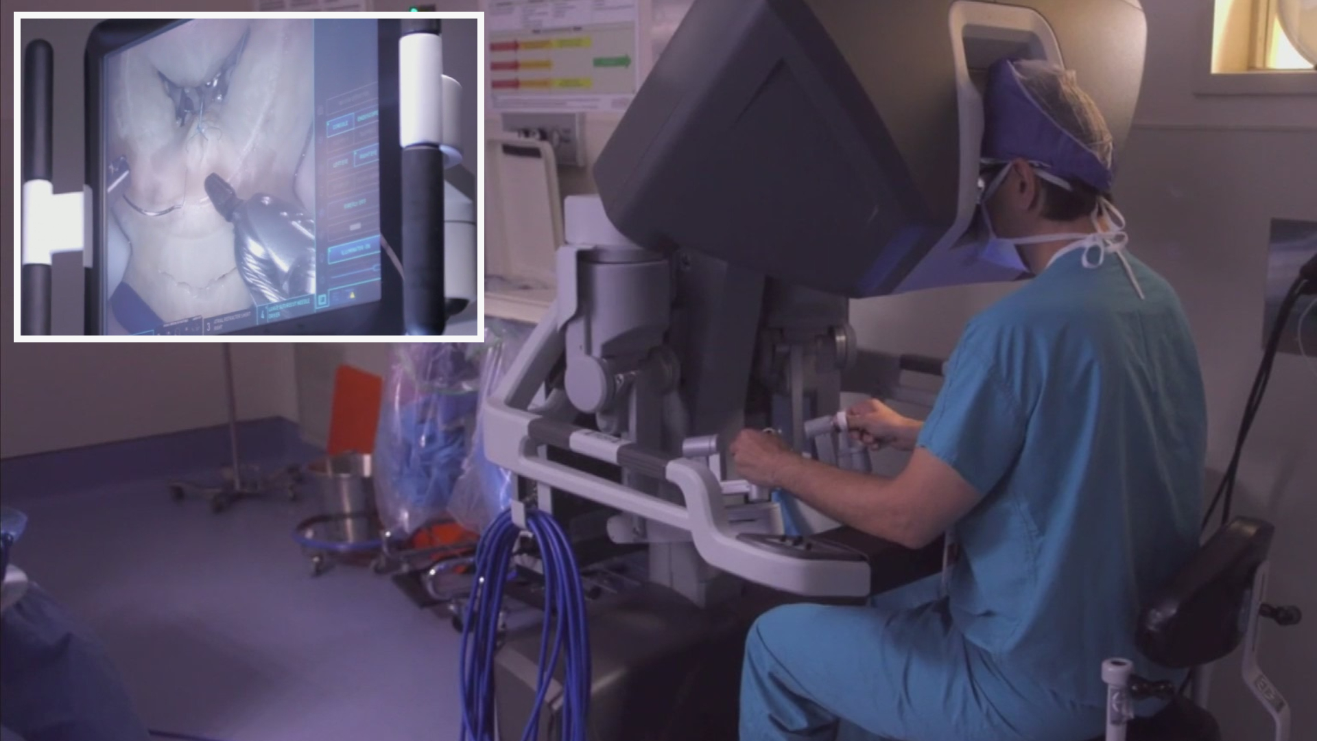 Cirugía de corazón con robot en Memorial Hermann promete una ...