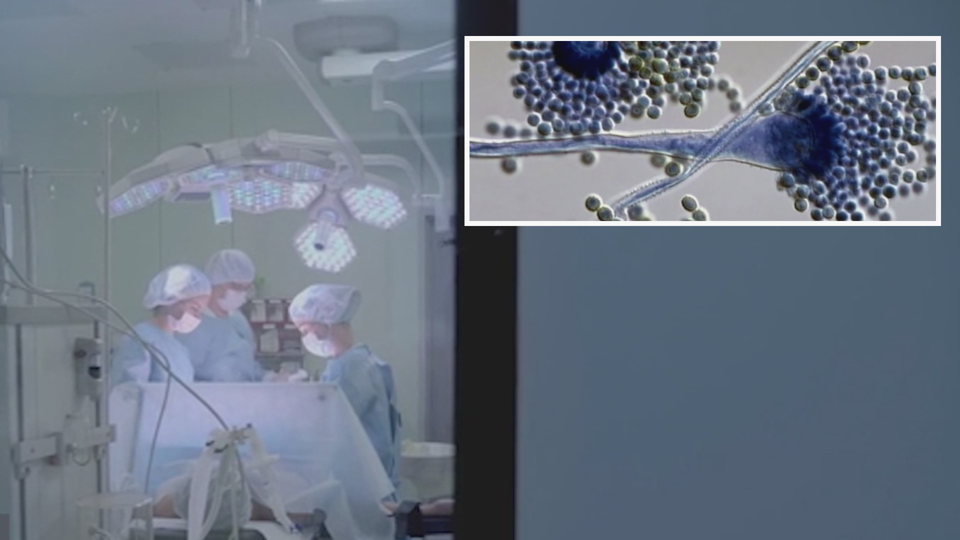 Síntomas de meningitis bacteriana y cómo se trata este virus en el área ...