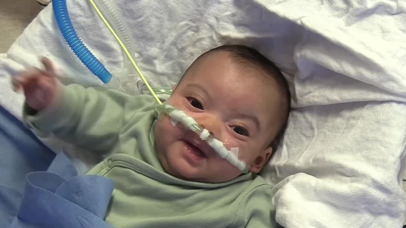 Bebé nace prematura y del tamaño de una lata de refresco: conoce su ...