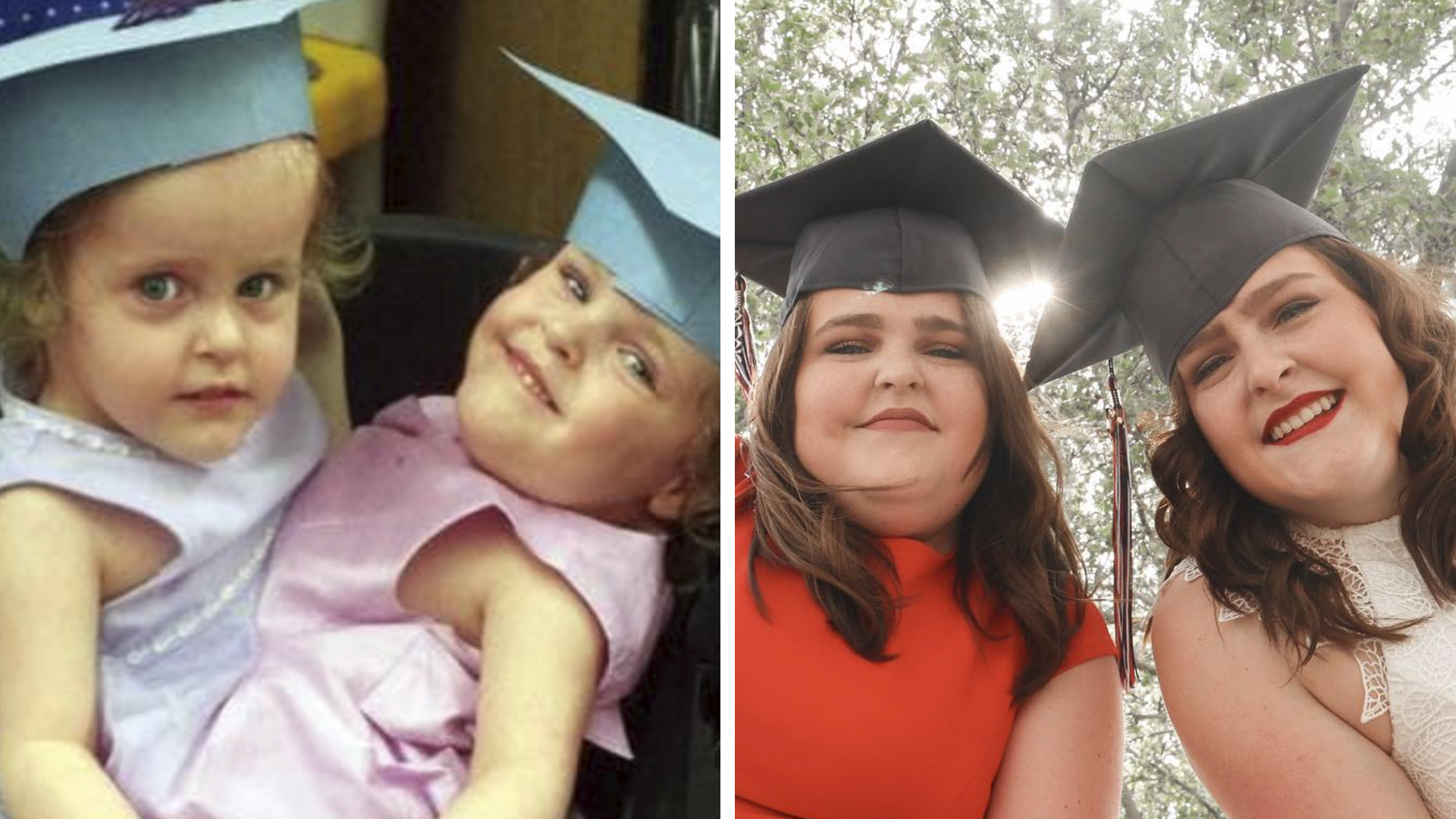 Kendra y Maliyah: La vida de las siamesas que fueron separadas desde ...