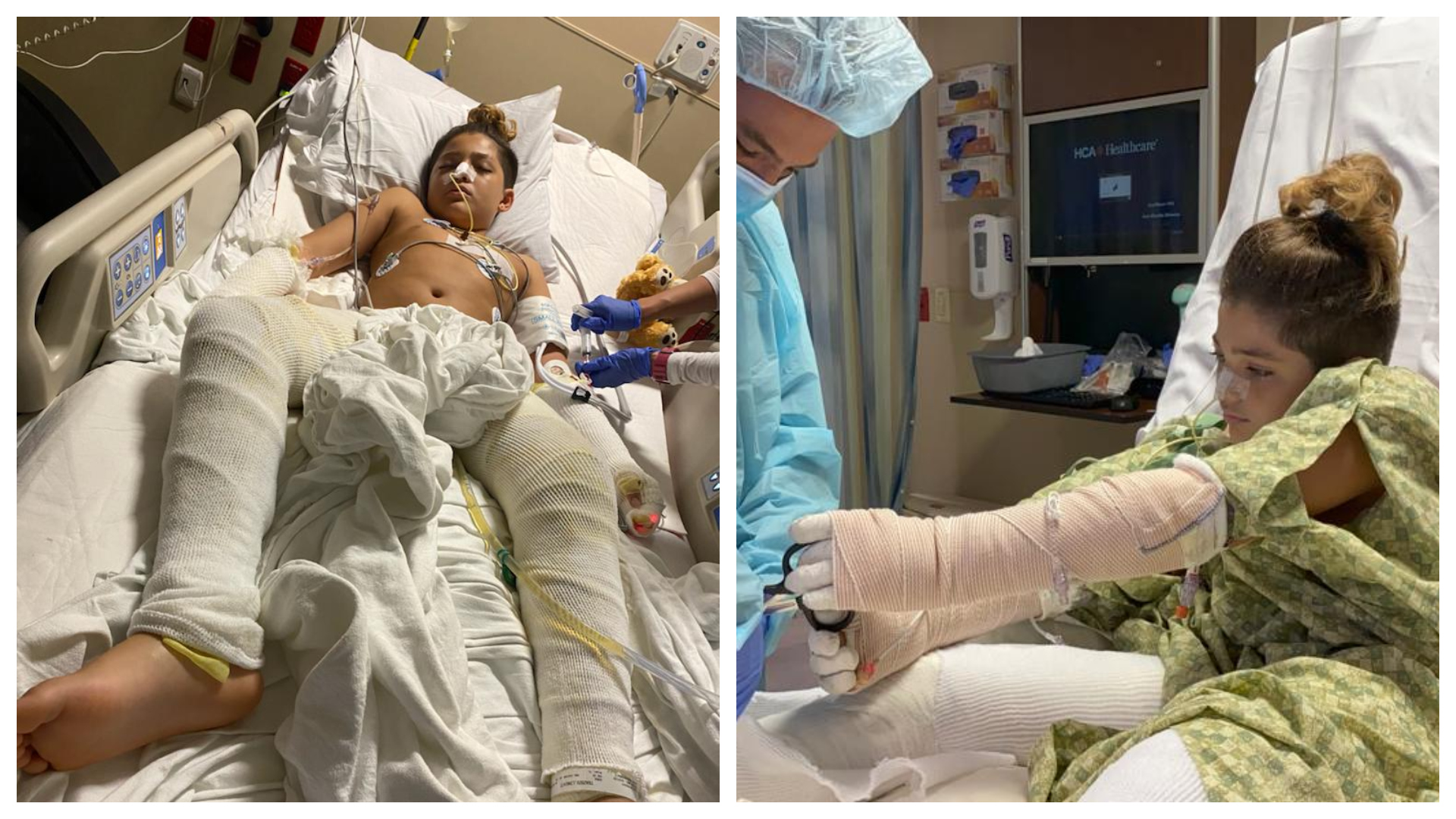 Nick Howell, el niño que se arrepiente después de que se quemó haciendo ...